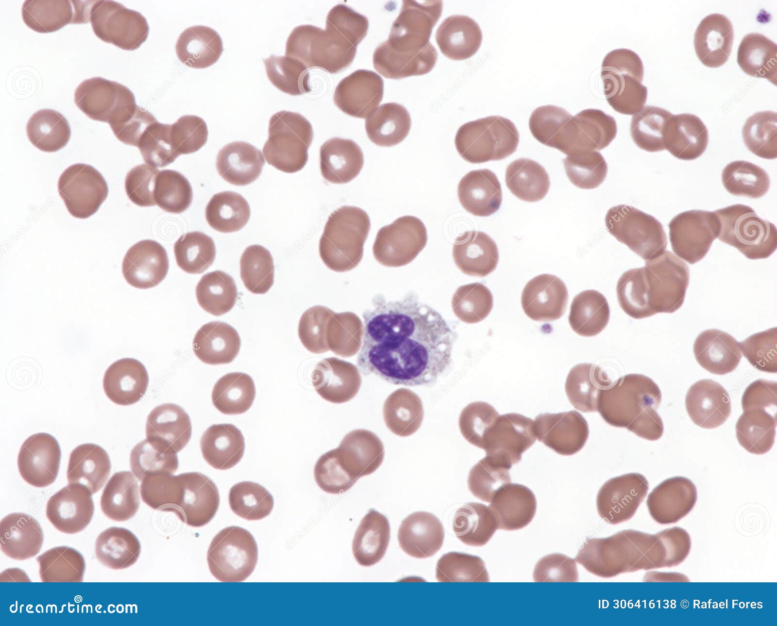Neutrophil number 8. stock photo. Image of medical, wright - 306416138