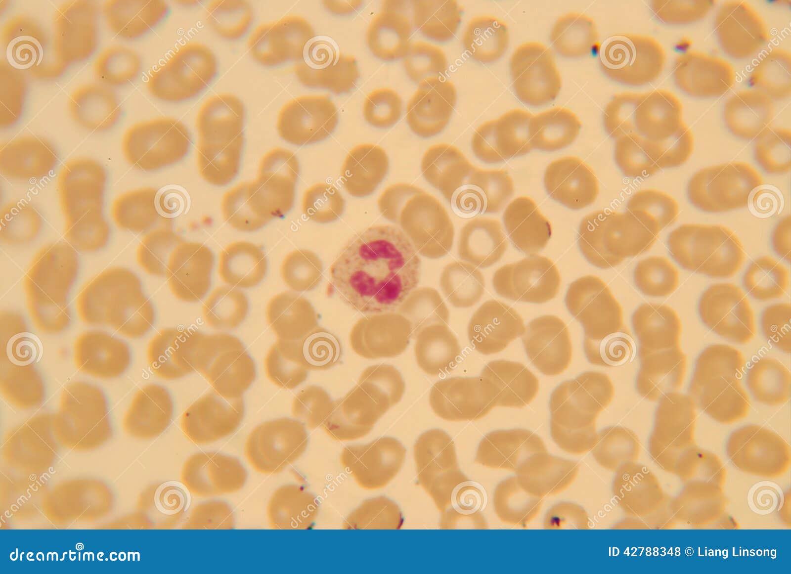 Neutrophil, toxic stock photo. Image of medical, white - 42788348