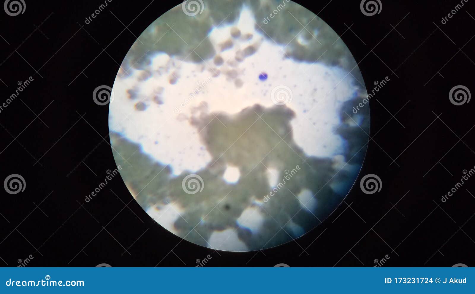 A Neutrophil Under the Microscope Stock Photo - Image of health ...