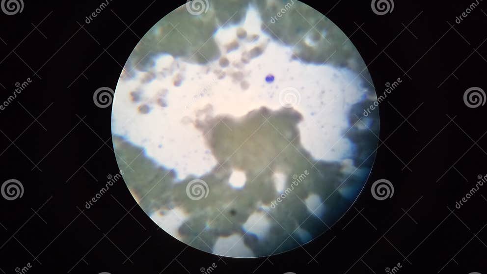 A Neutrophil Under the Microscope Stock Photo - Image of health ...