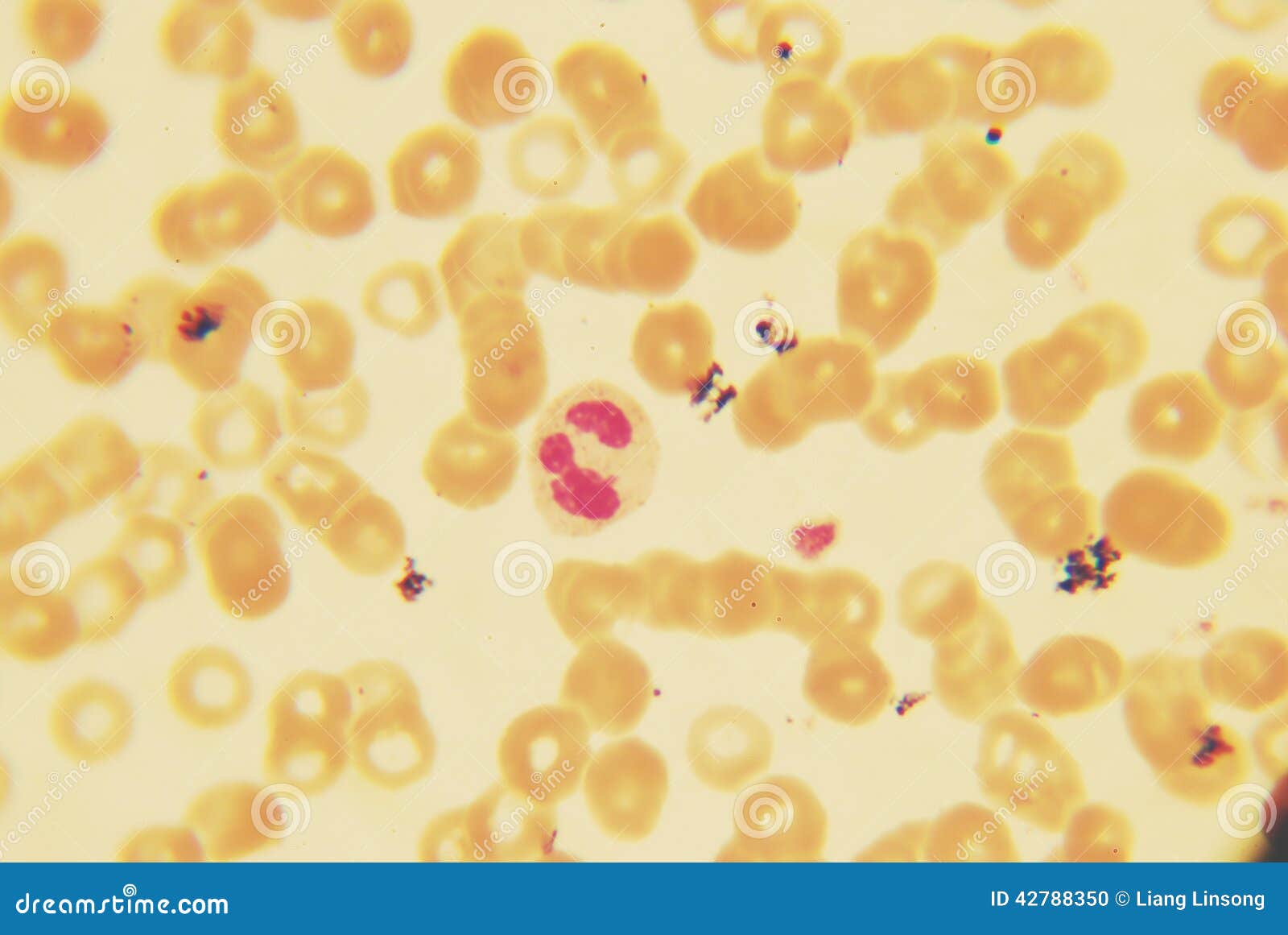 Neutrophil stock photo. Image of deoxyribonucleic, immersion - 42788350