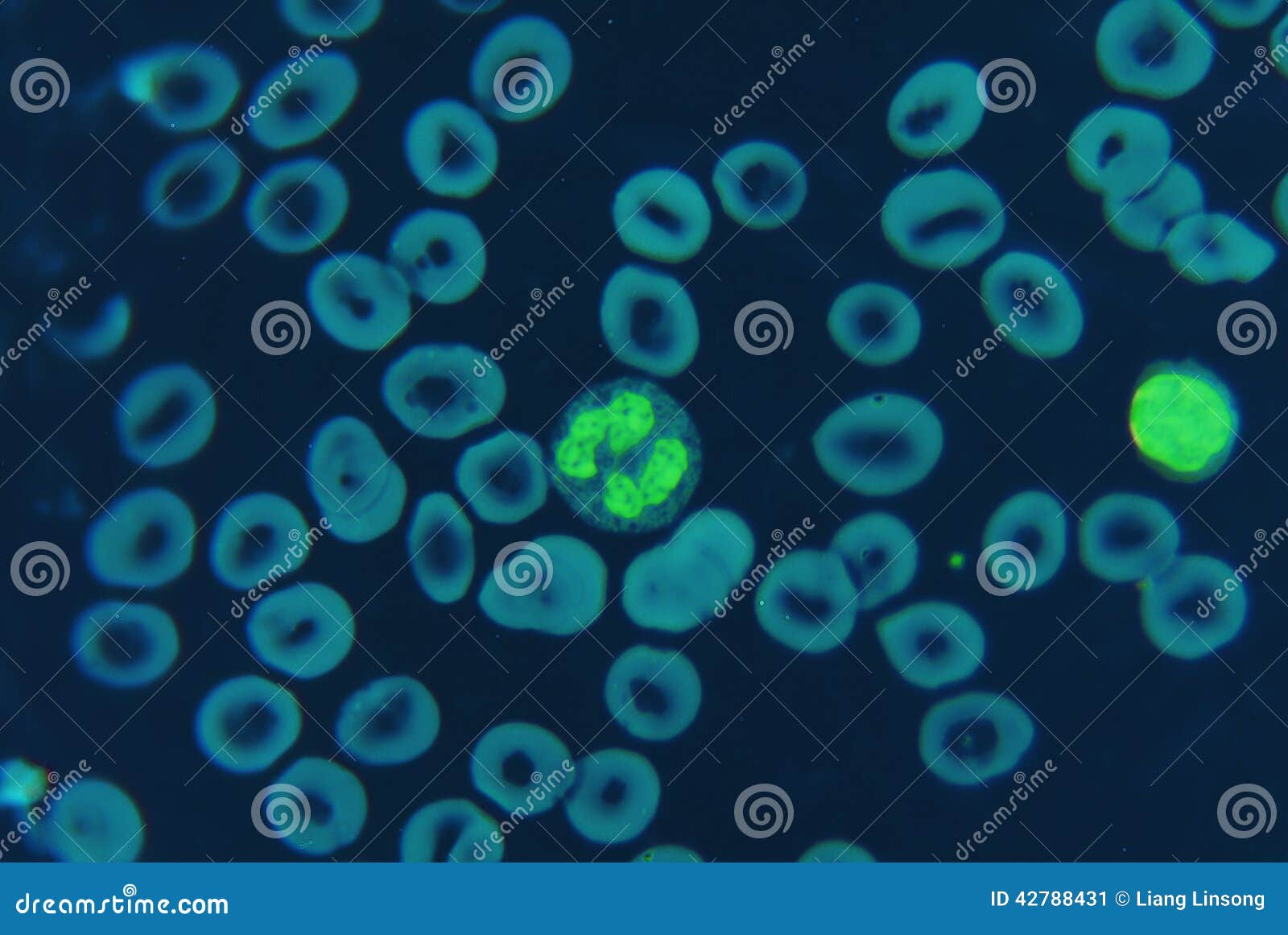 Neutrophil stock image. Image of lens, acid, fluorescence - 42788431