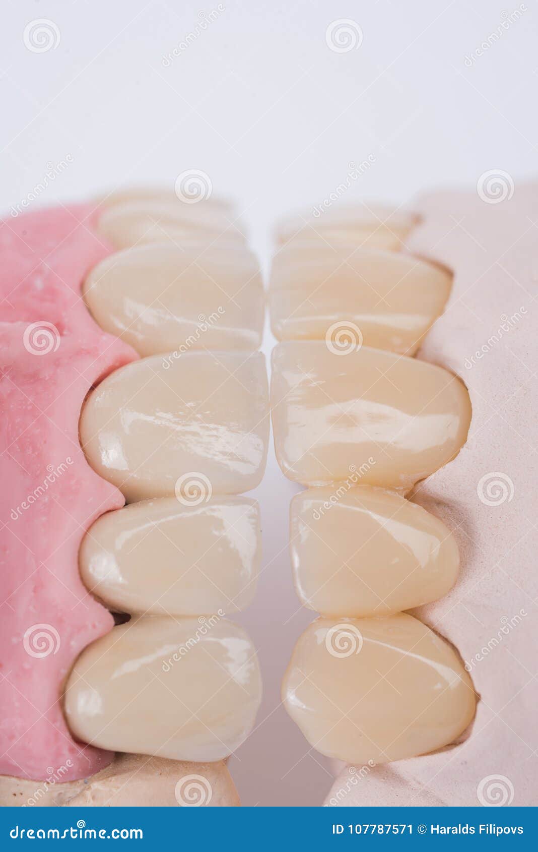 New White Ceramic Dentures on a Light Background Stock Image - Image of ...