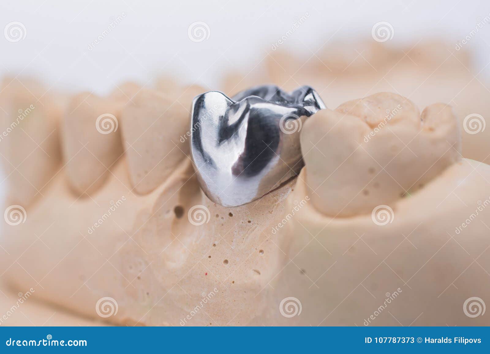New Dentures with One Metal Tooth on a Light Background Stock Image ...