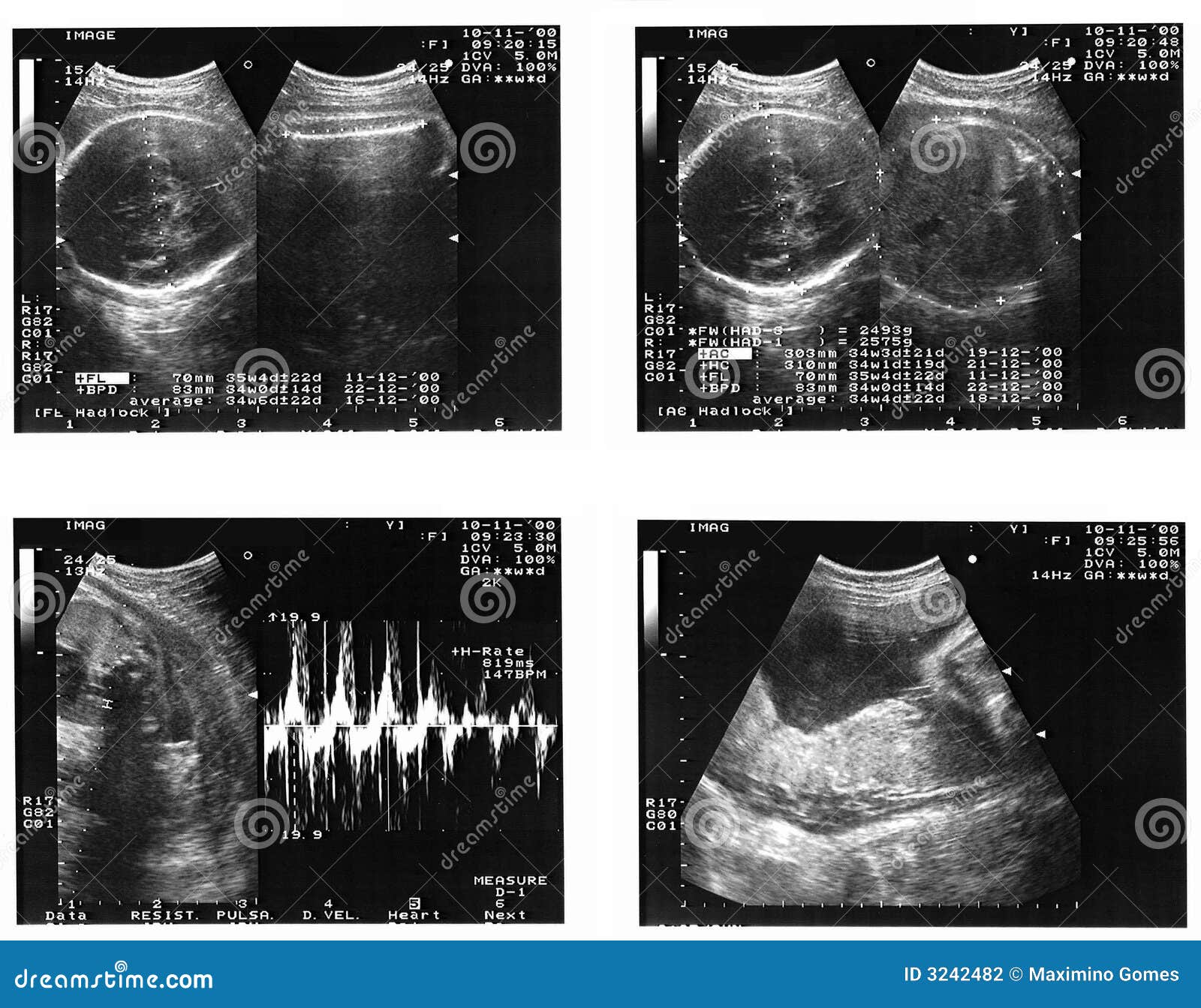 A new life... stock photo. Image of lungs, column, laboratory - 3242482