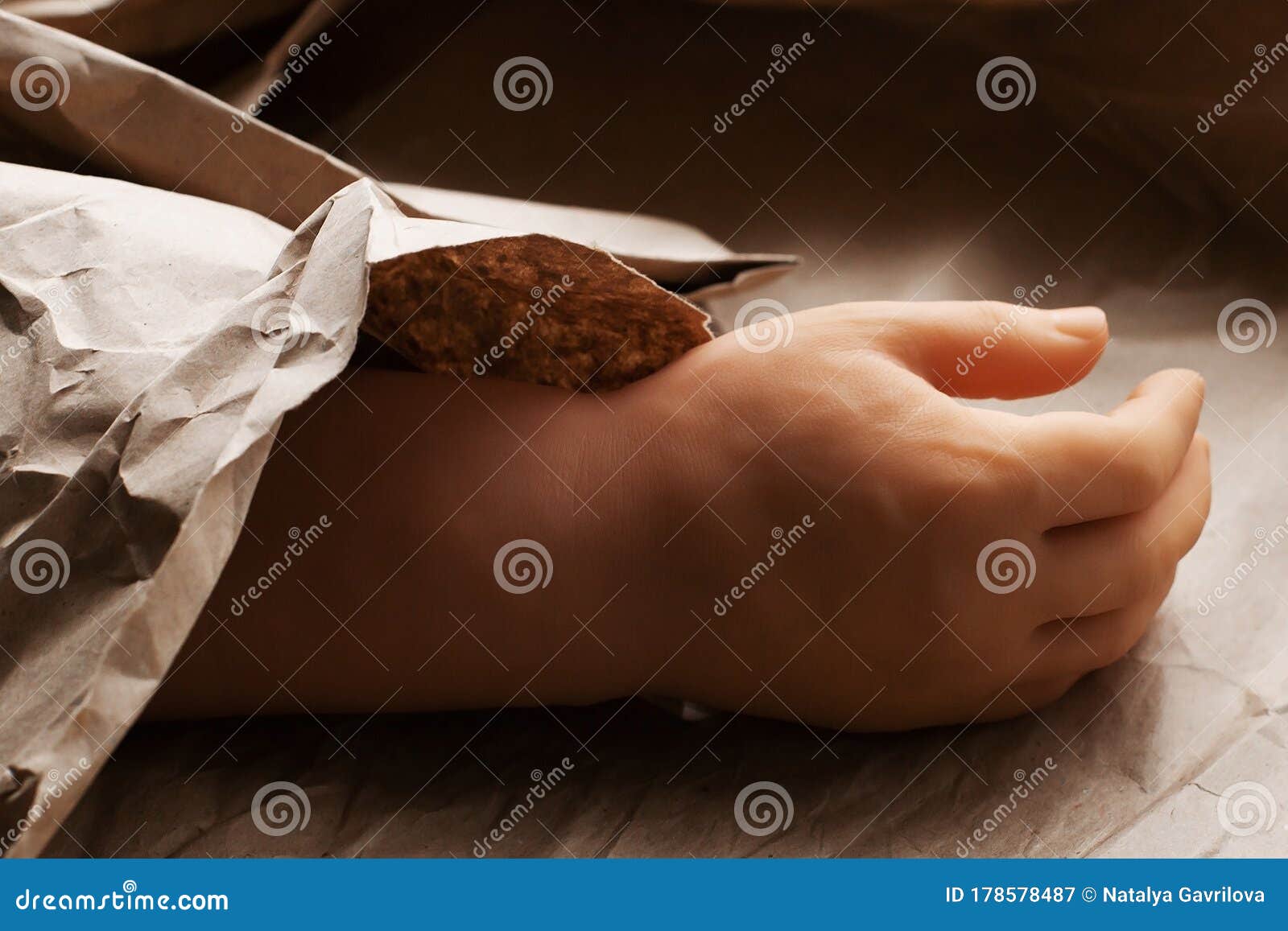 New Prosthetic Arm in Packaging Stock Image - Image of human, equipment ...