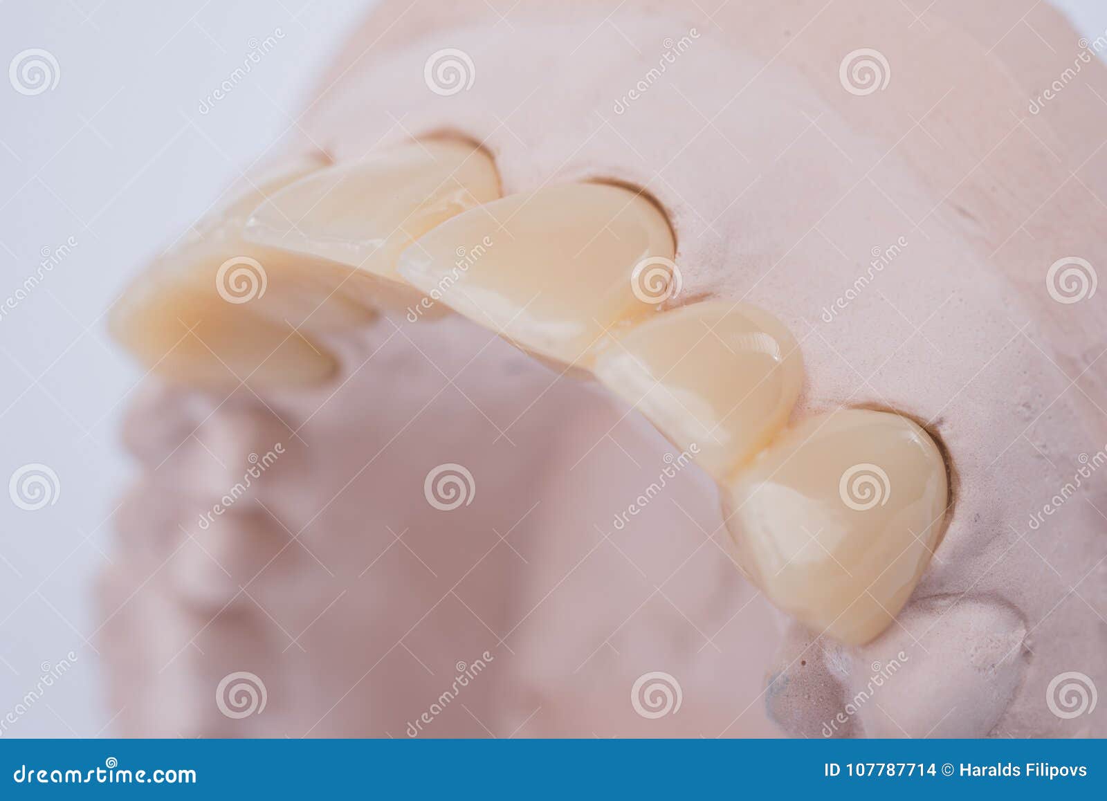 New White Ceramic Dentures On A Light Background Stock Photo - Image of ...