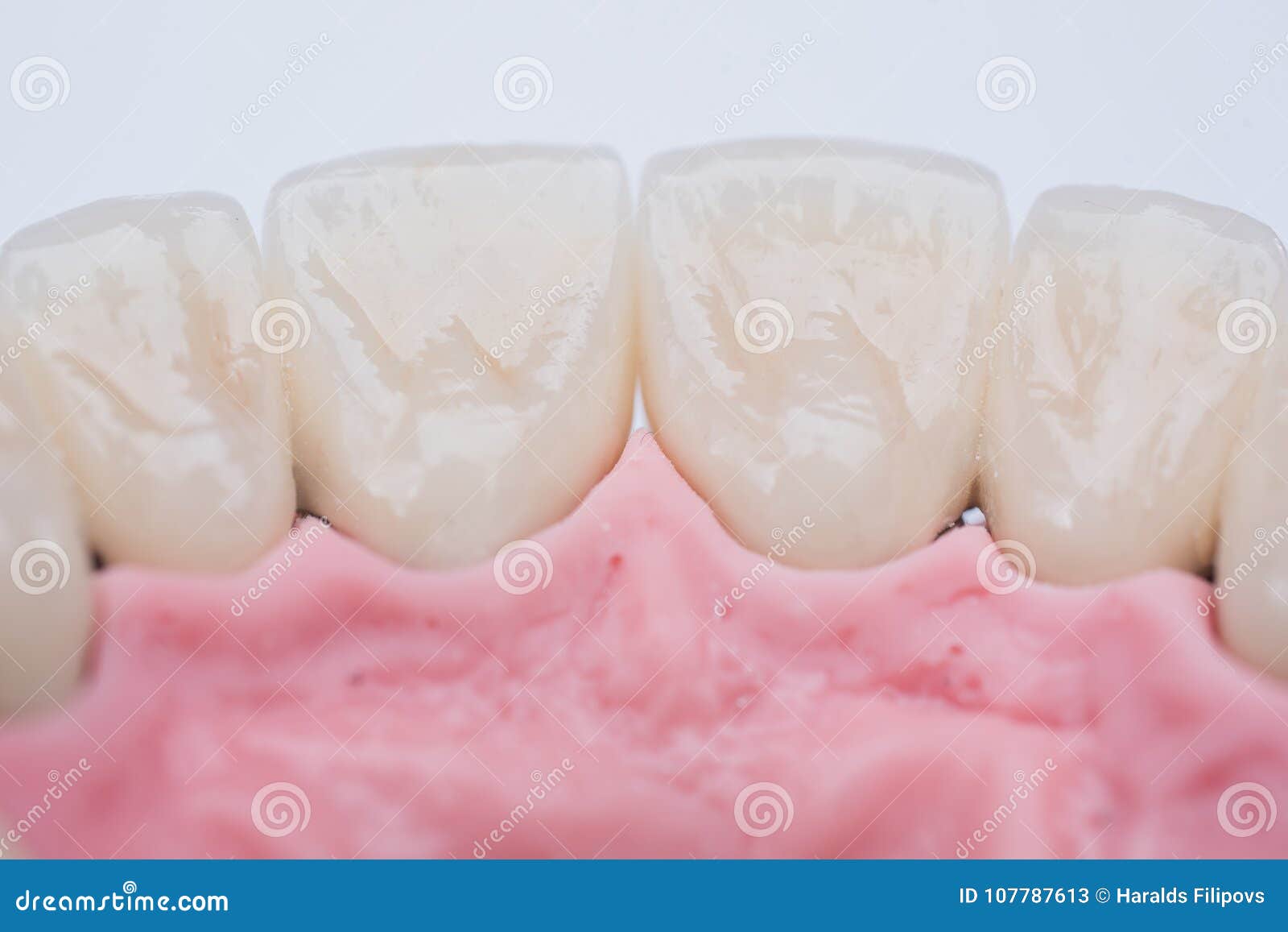 New White Ceramic Dentures On A Light Background Stock Image - Image of ...