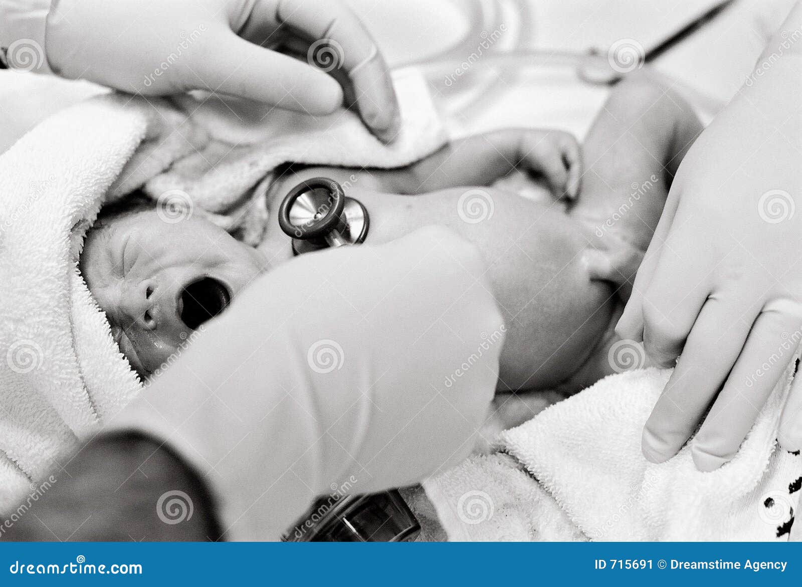 Newborn Baby With Skin Rash. Allergic Reaction After Birth Royalty-Free ...