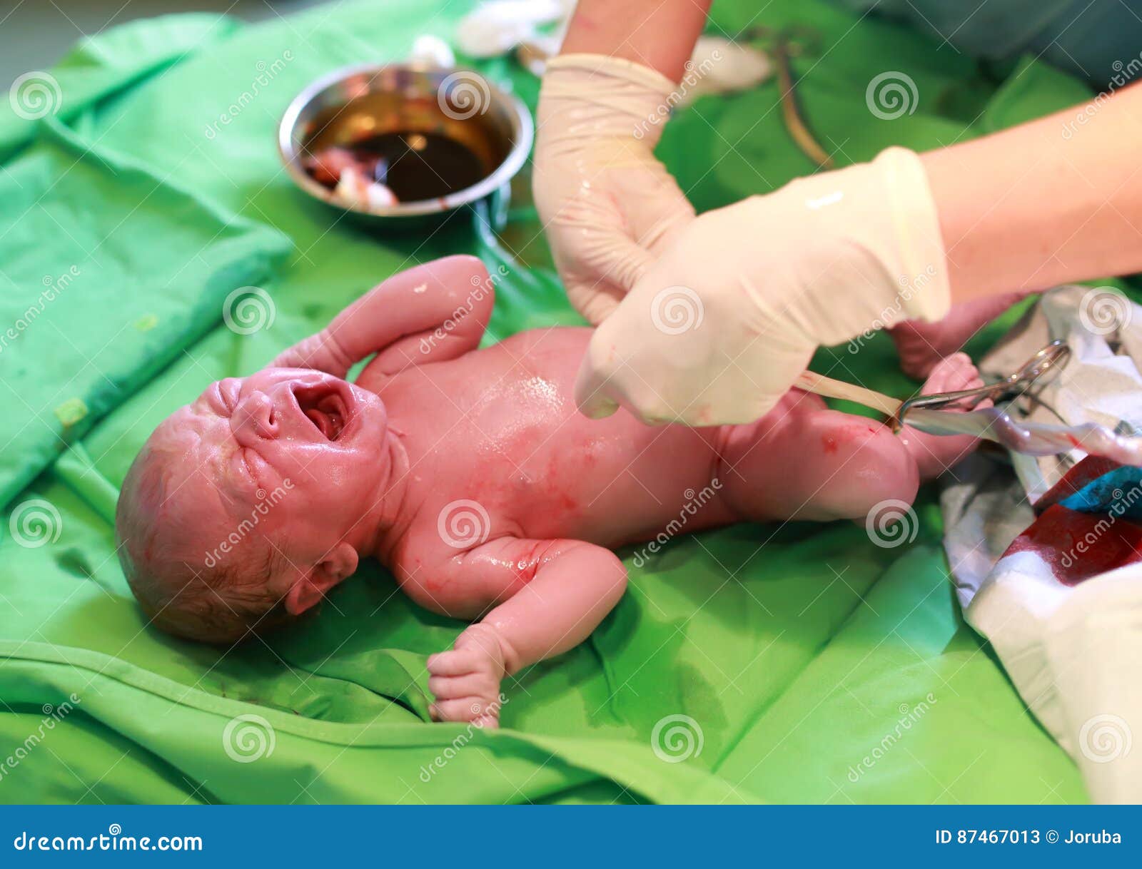 Newborn baby after birth stock image. Image of help, nurse - 87467013