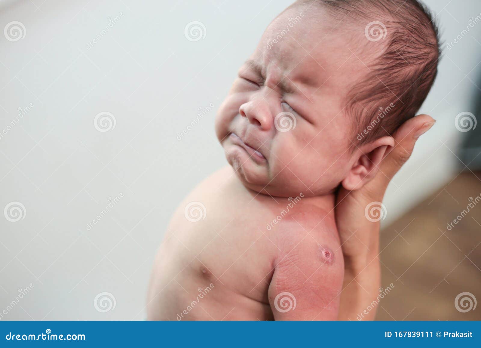 Newborn Baby with Red Spots Due To Injection Stock Image - Image of ...