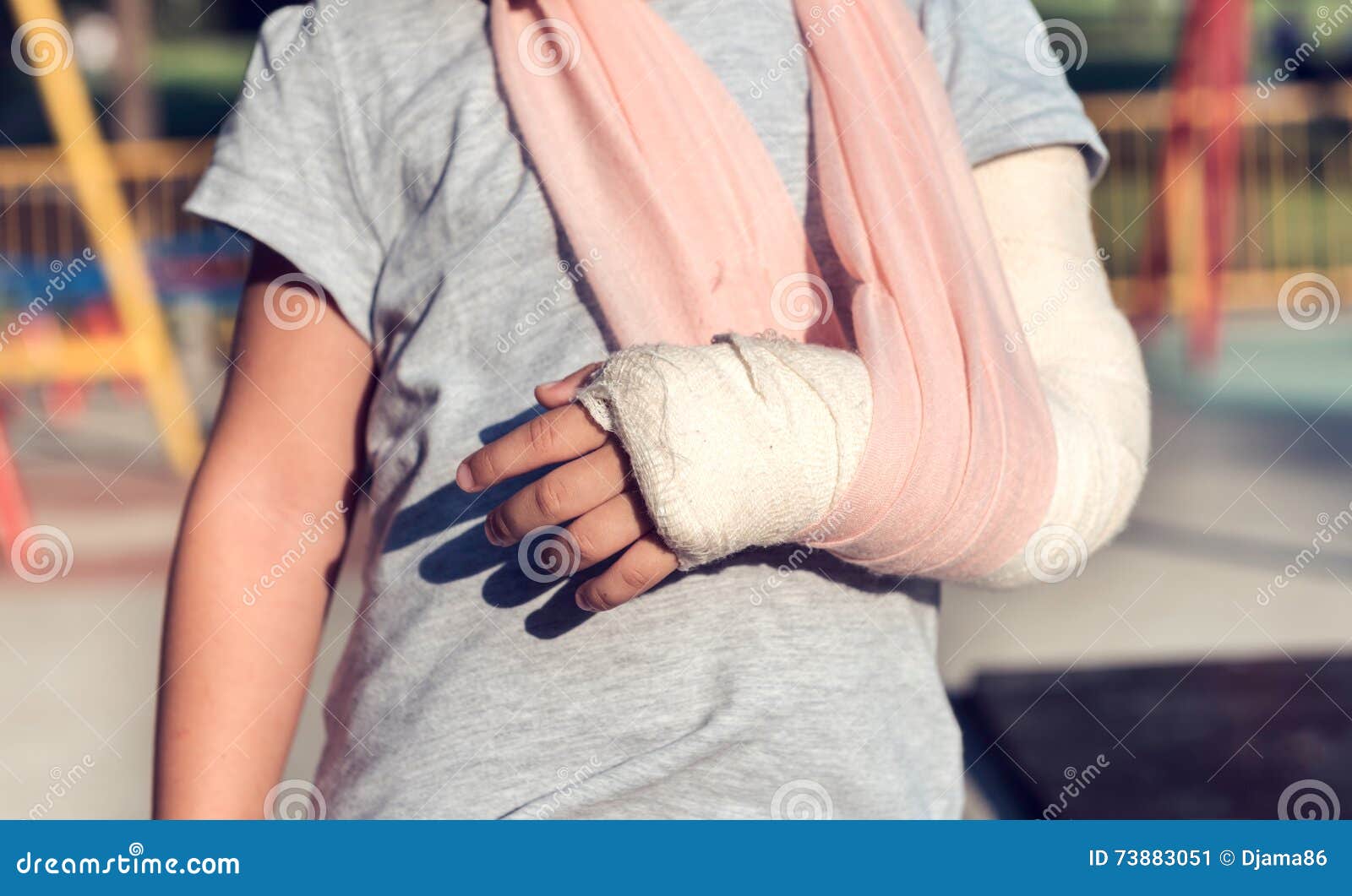 Niño con la mano quebrada imagen de archivo. Imagen de cabrito - 73883051