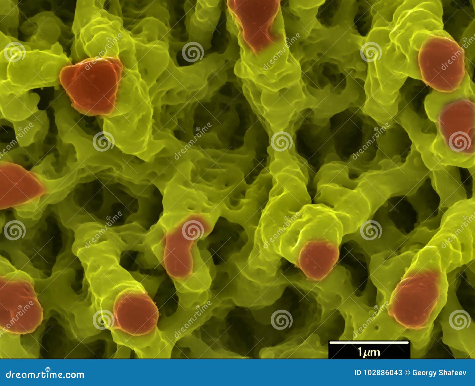 Nickel Microstructures Done by Short Laser Pulse Stock Image - Image of ...