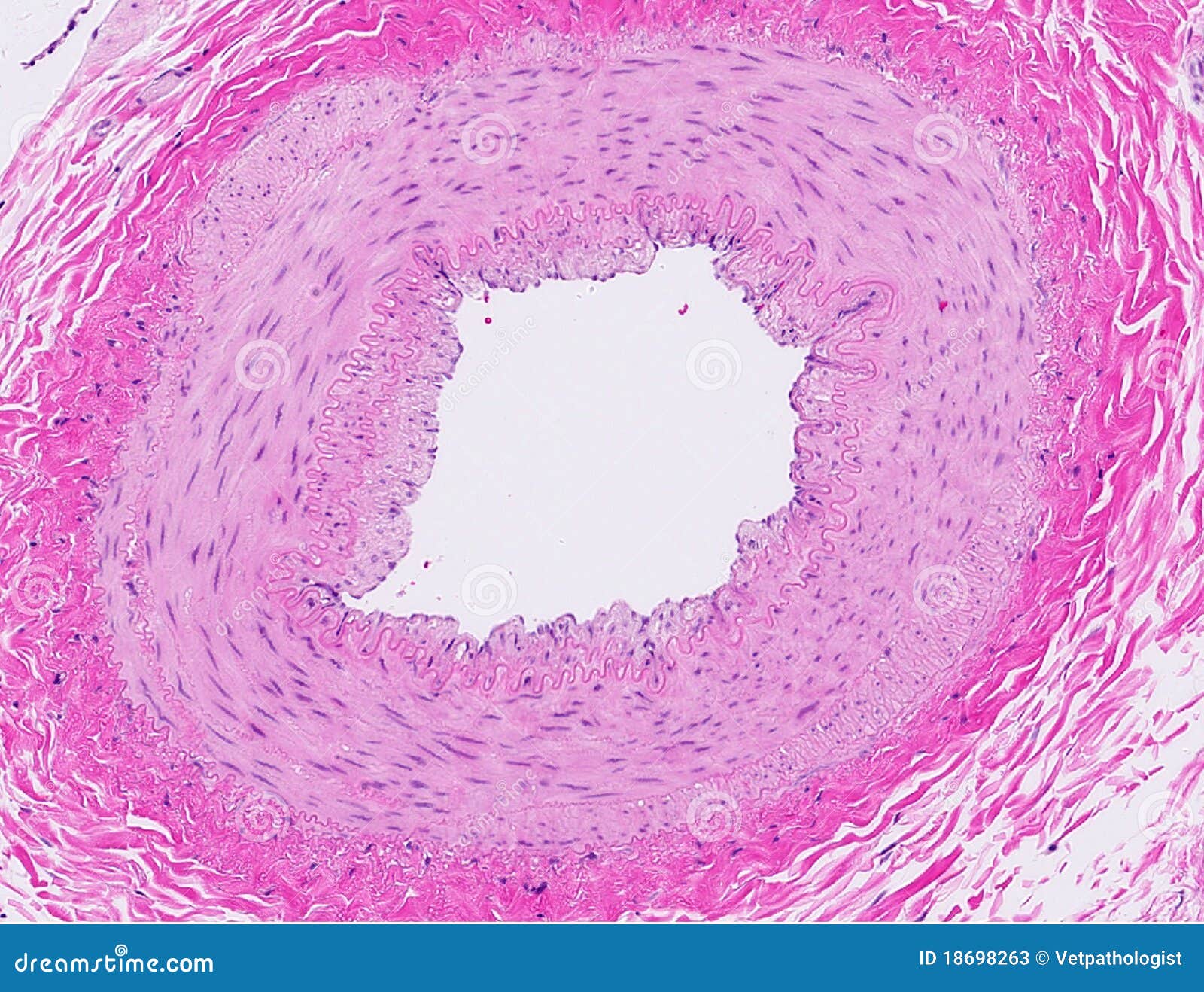 Nier elastische slagader stock afbeelding. Image of microscopisch ...