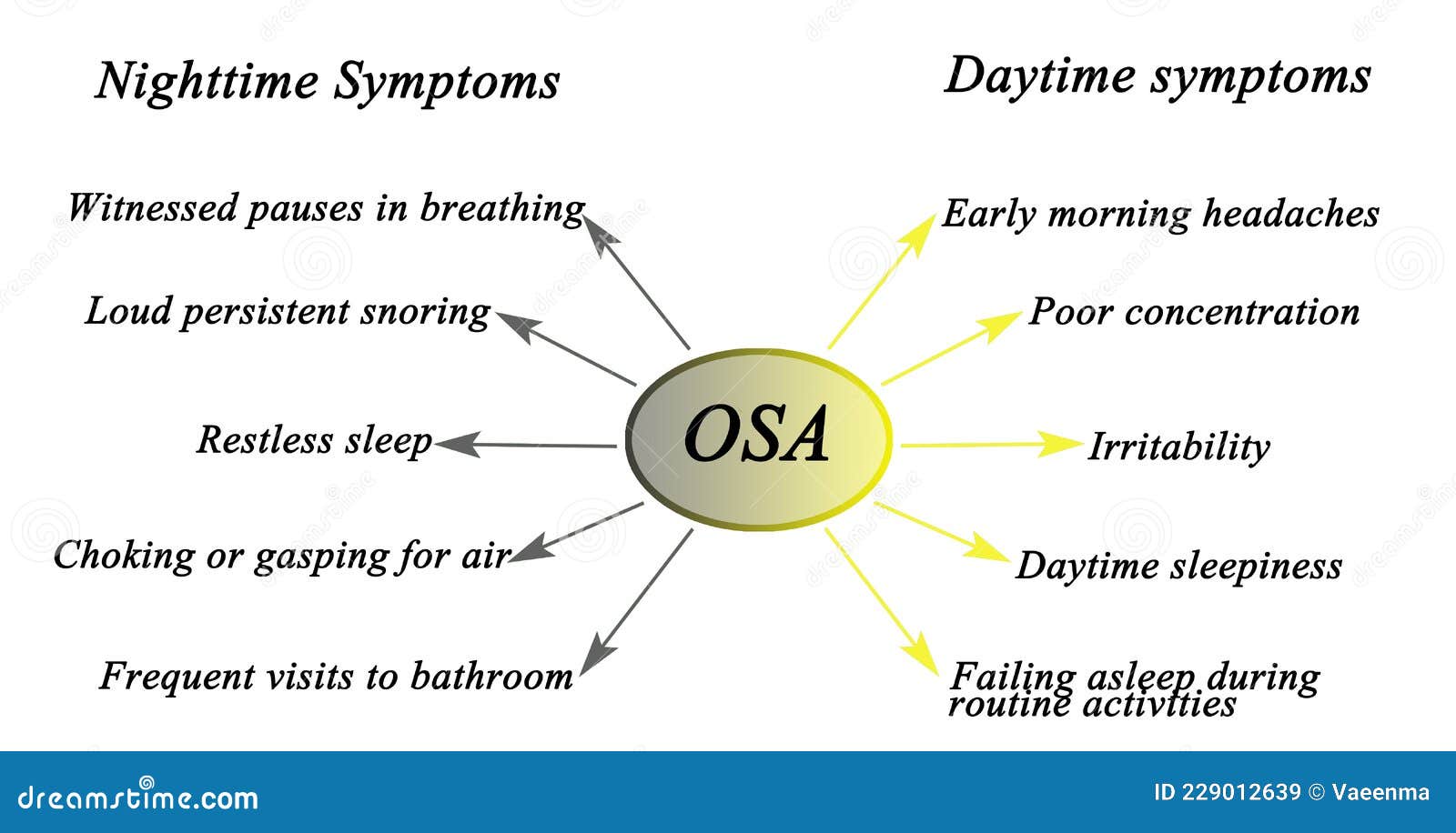 Nighttime and Daytime Symptoms of OSA Stock Illustration - Illustration ...