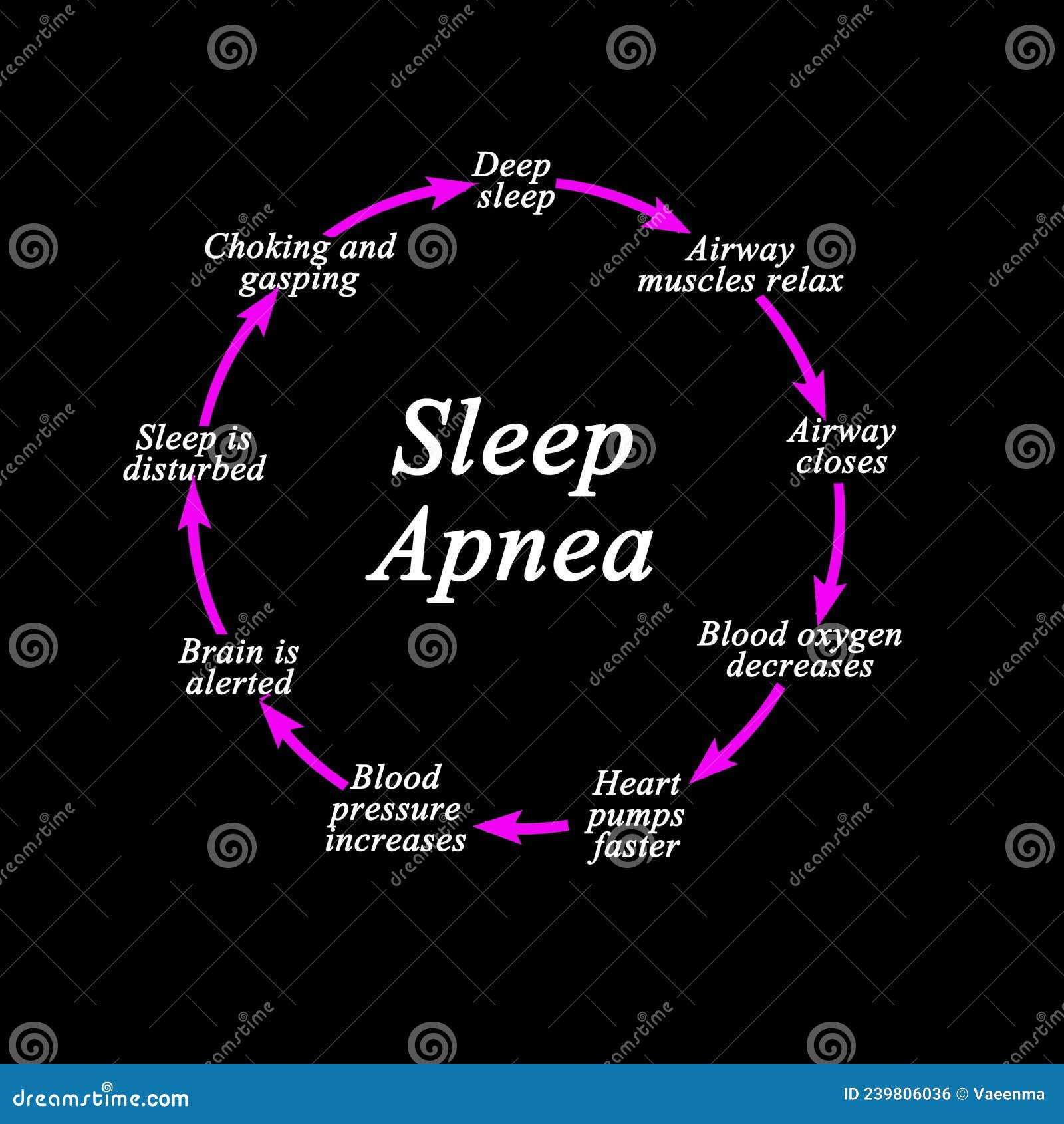 Sleep Stages Illustration. The Figure Shows A Pie Chart Of Stages Of ...