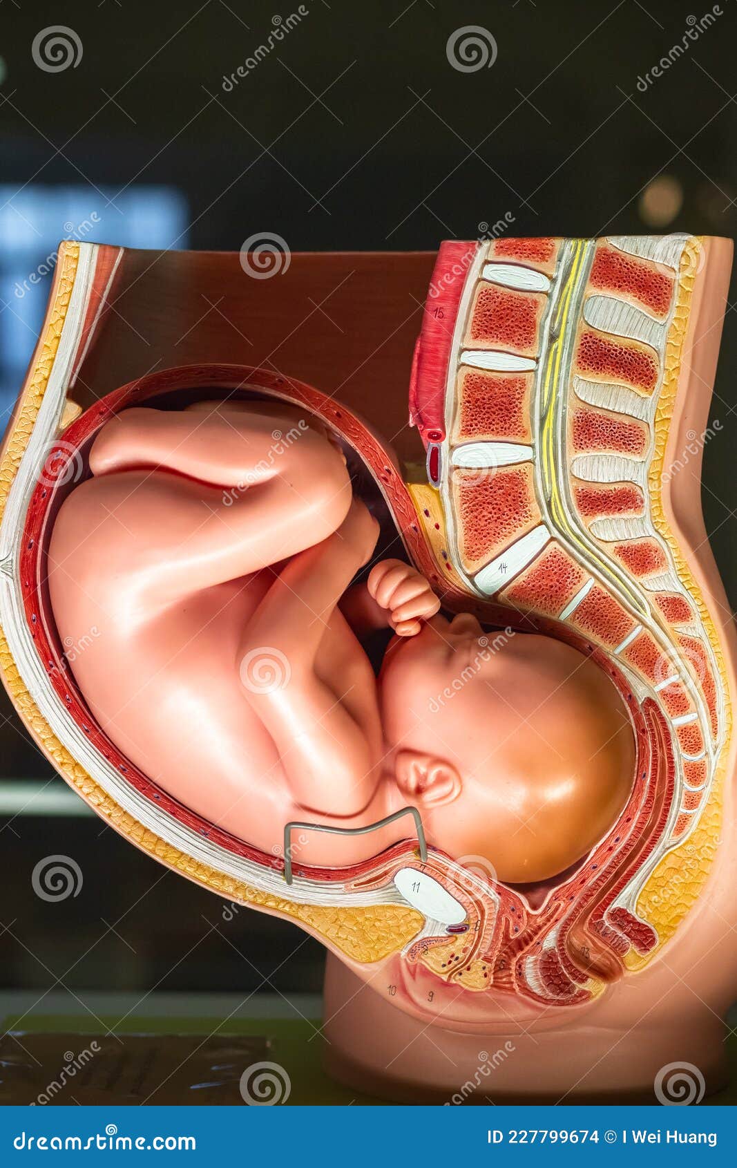Anatomy Of Pelvis Of Woman Gynecology Of Uterus And Pelvic Bones