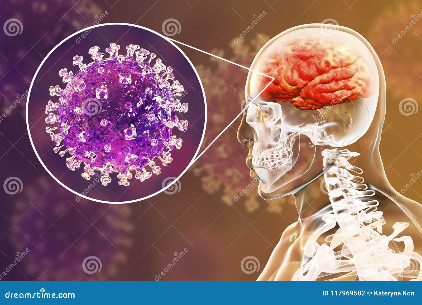 Nipah Virus Attaching Receptors On Human Cells, A Newly Emerging Bat ... Nipah Virus Attaching Receptors On Human Cells, A Newly Emerging Bat ...