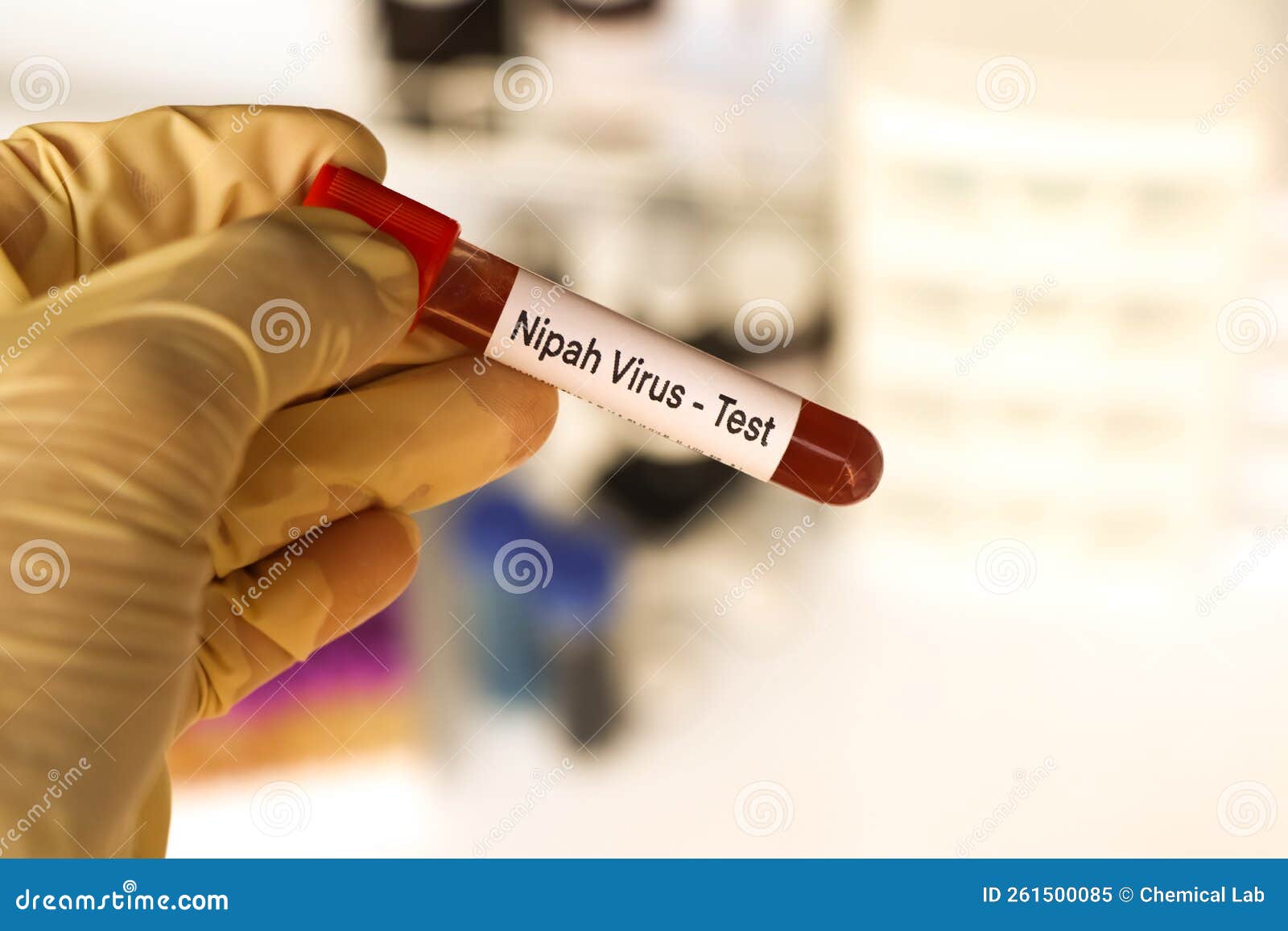 Nipah Virus Test To Look for Abnormalities from Blood Stock Image ...