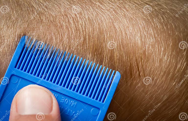 Nit picking stock photo. Image of searching, child, parasite - 20785200