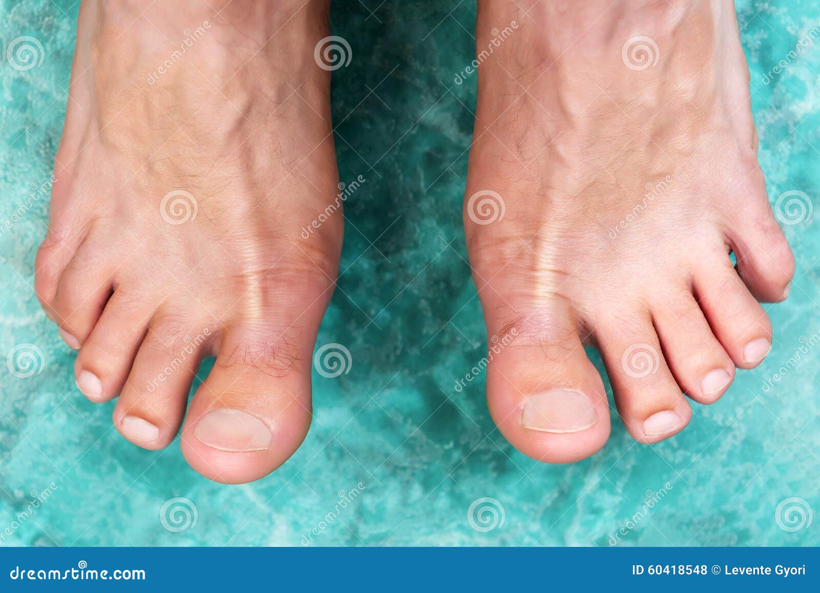 No skin problems stock photo. Image of human, home, care - 60418548