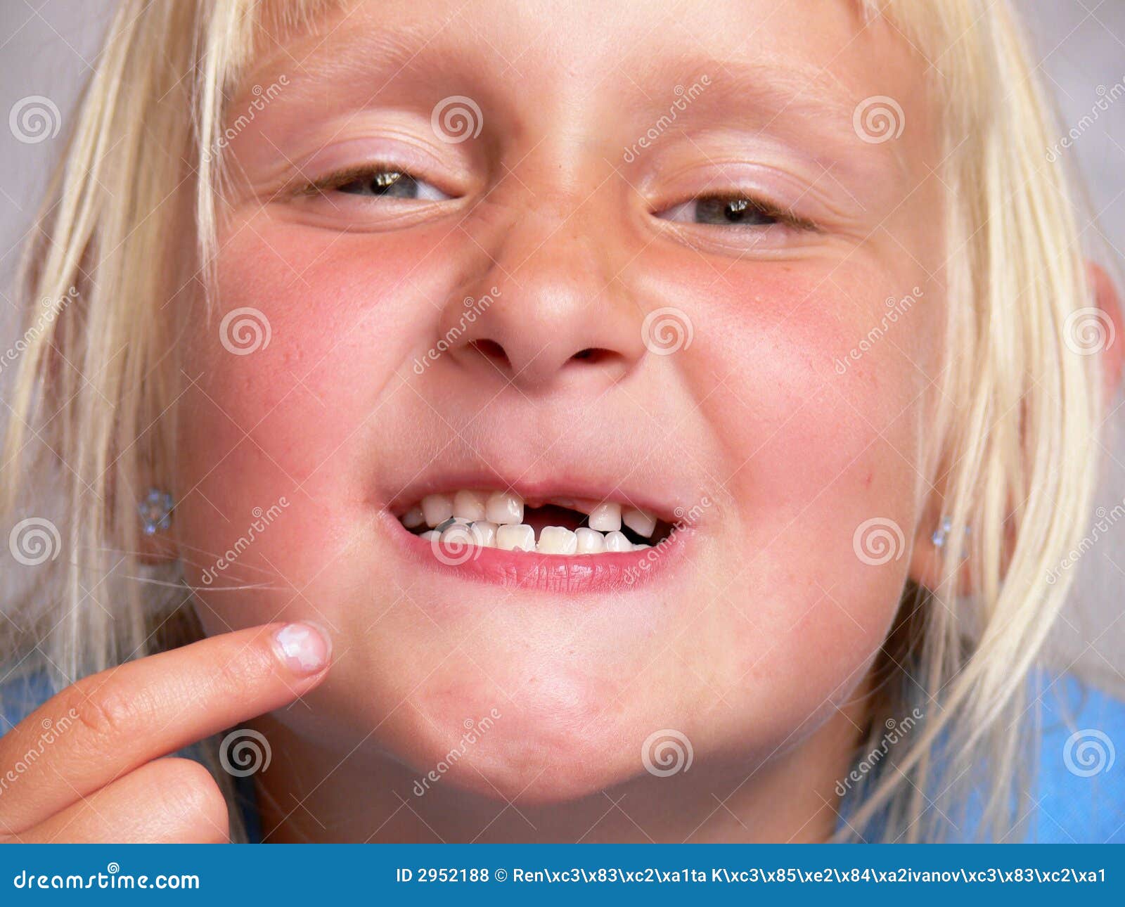 No Tooth Picture. Image: 2952188