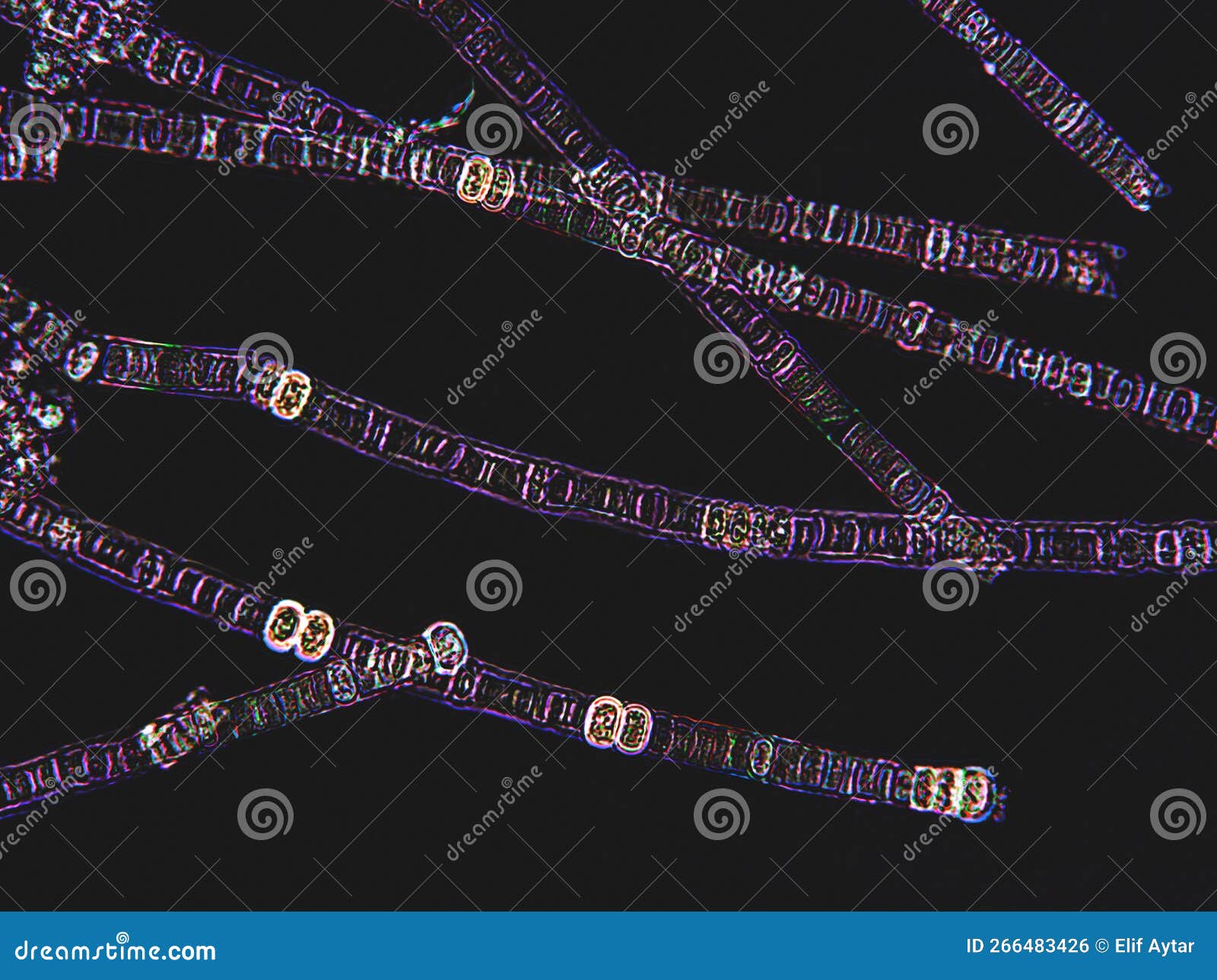 Nodularia Sp. Toxic Algae Under Microscopic View X40, Dark Background ...