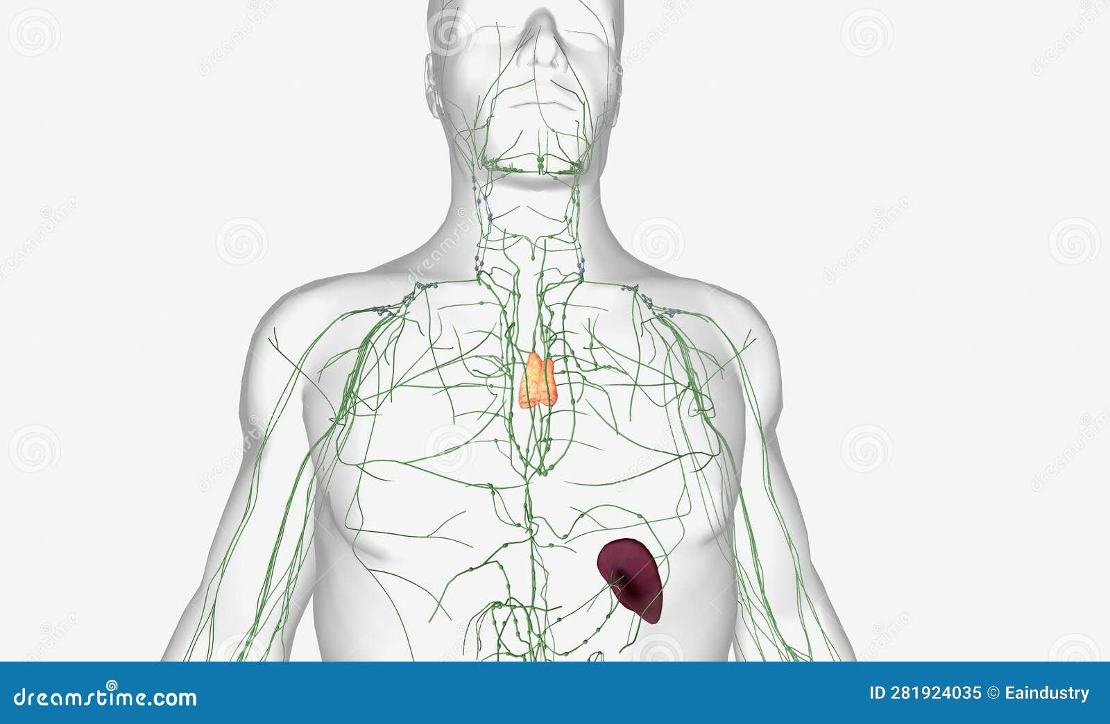 Non Hodgkin is Lymphoma in Lymph Node Stock Illustration - Illustration ...