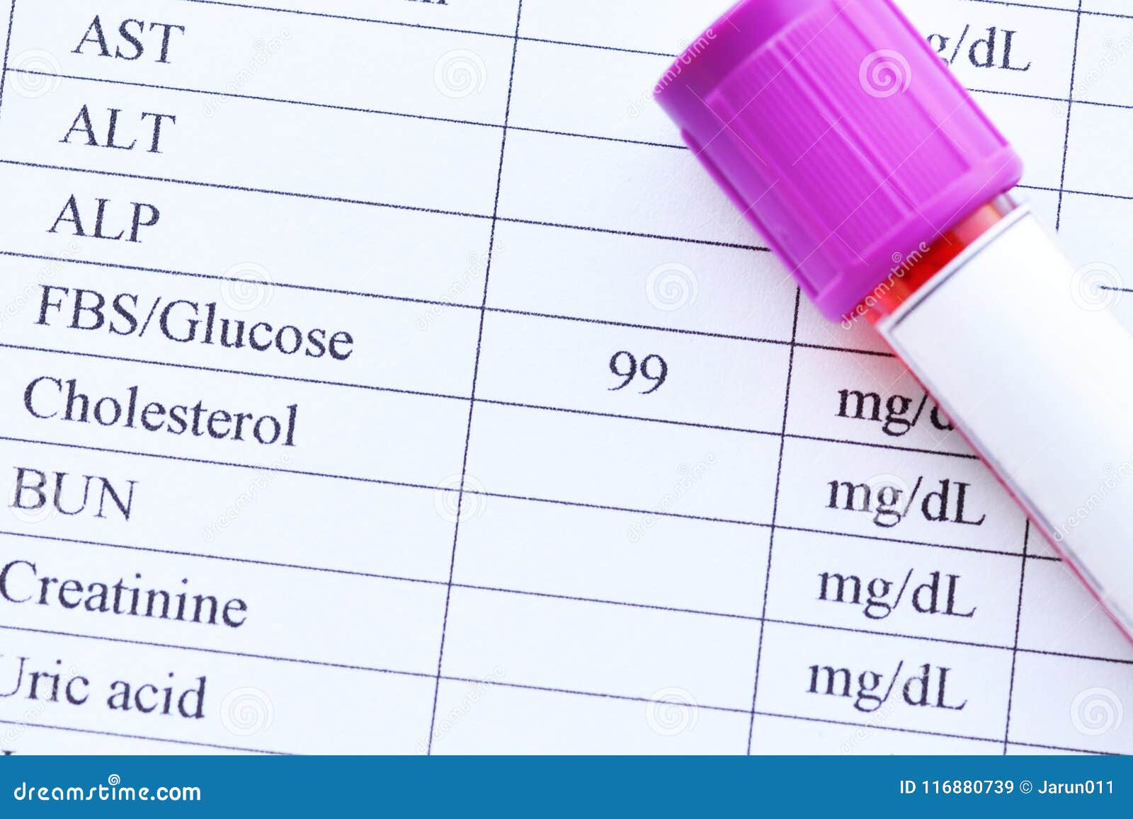 Normal Blood Sugar Test Result Stock Image - Image of health ...