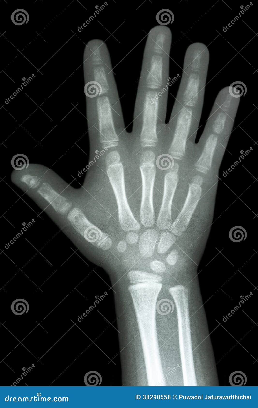 Normal child s hand stock photo. Image of doctor, healthcare - 38290558