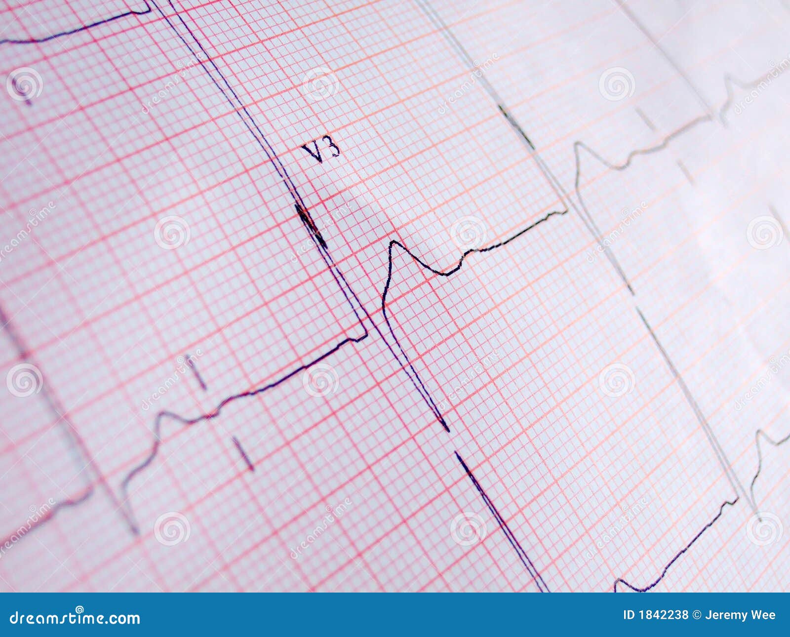 Normal ECG stock photo. Image of healthcare, screen, cardiologist - 1842238