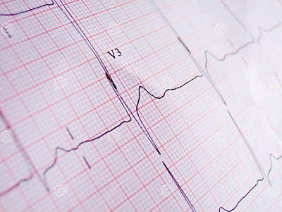 Normal ECG stock photo. Image of healthcare, screen, cardiologist - 1842238