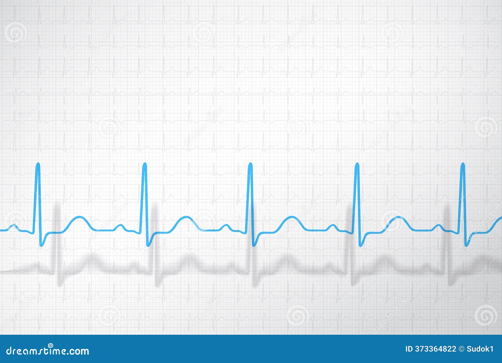 Normal ECG Chart Of Healthy Man, Conceptual Vector Background ...