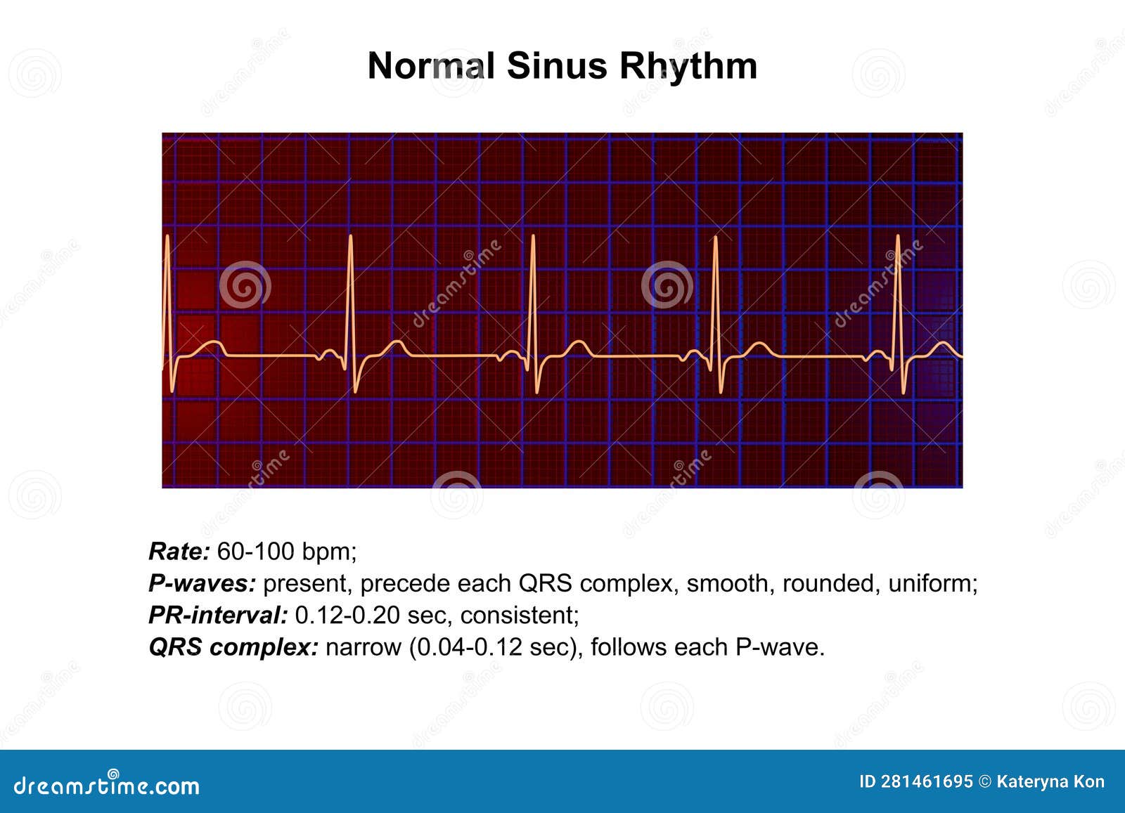 A Normal Electrocardiogram, 3D Illustration Stock Illustration ...