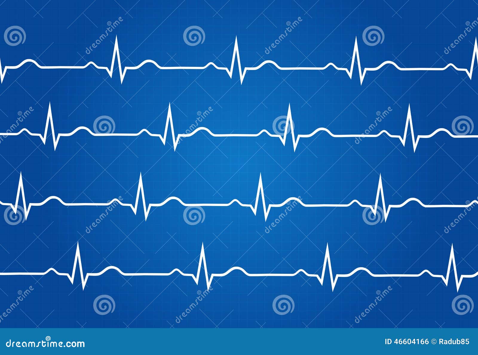 Normal Electrocardiogram, EKG, ECG With Heart In The Middle. Heartbeat ...