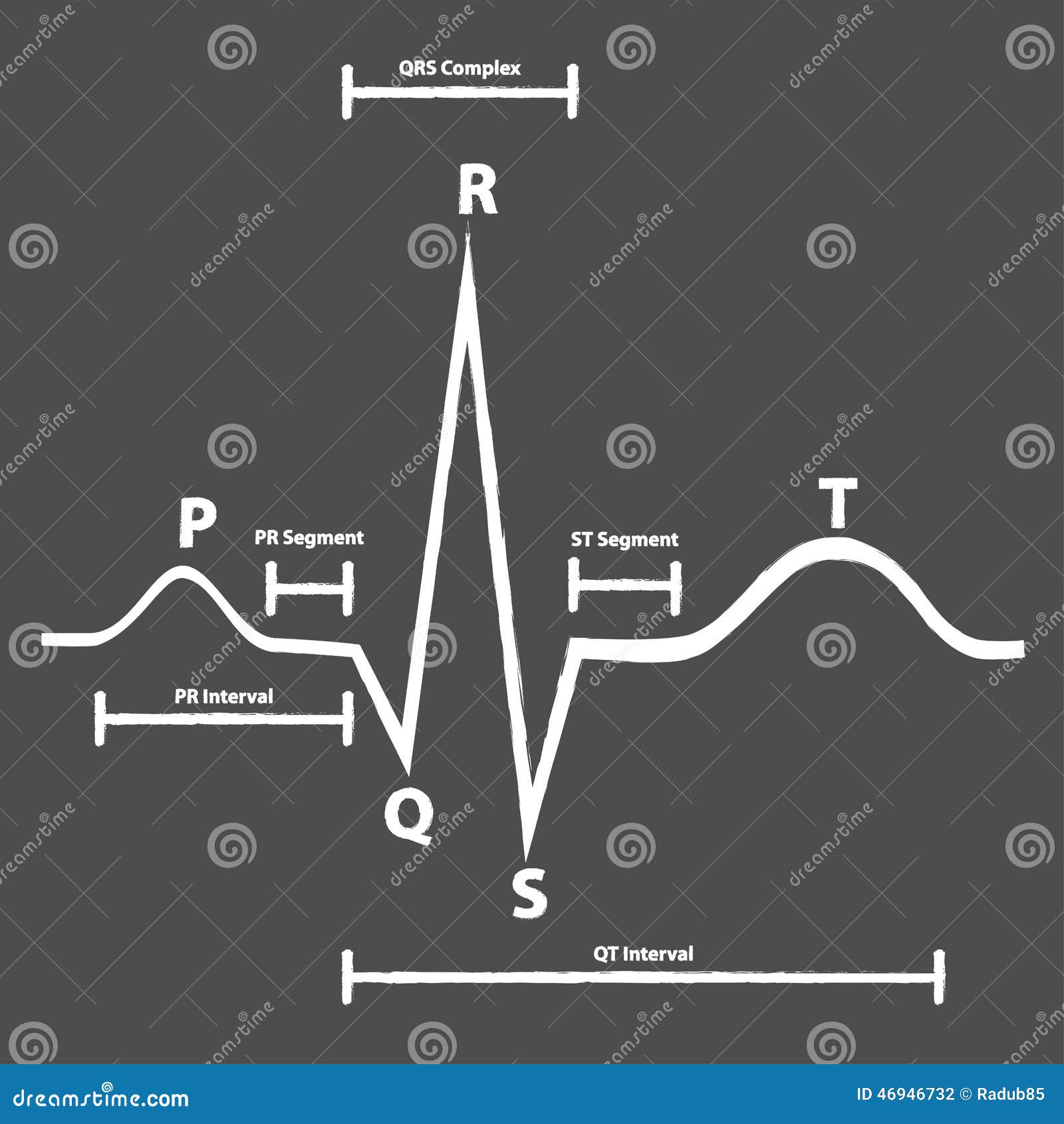 Normal Electrocardiogram, EKG, ECG With Heart In The Middle. Heartbeat ...