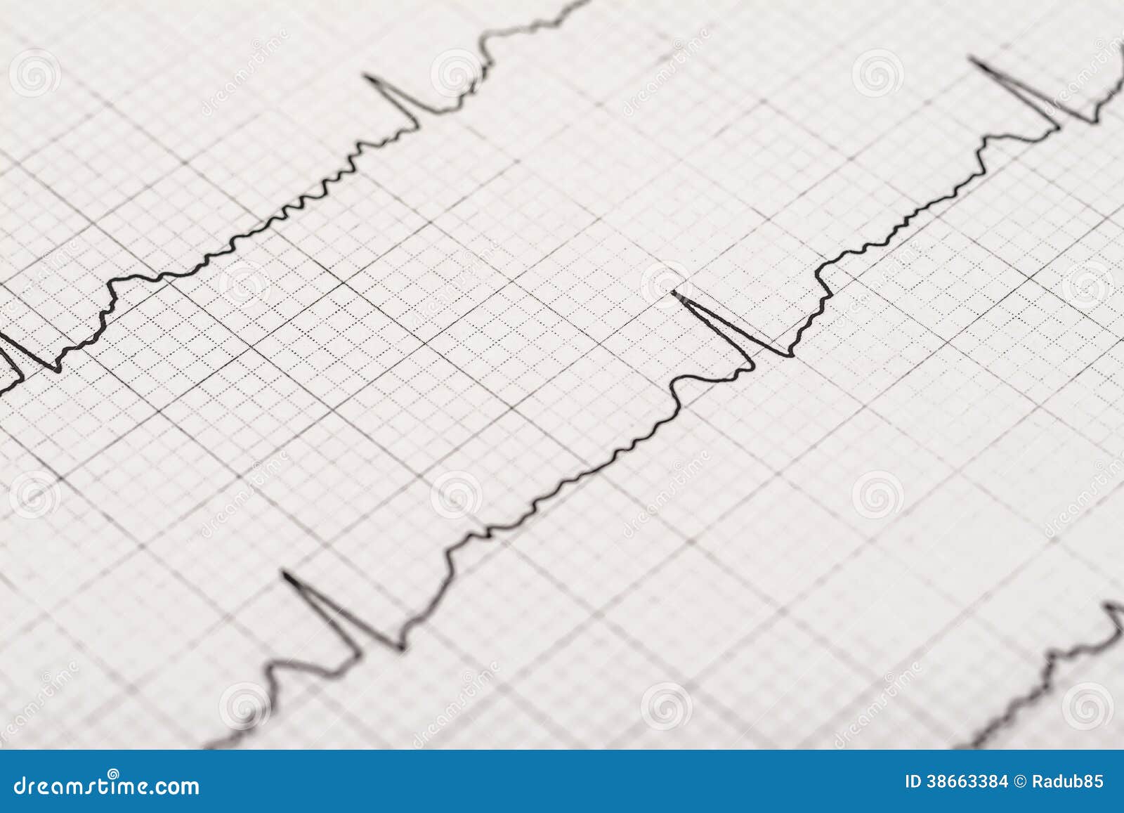 Normal Electrocardiogram Record Stock Photo - Image of cardiac ...