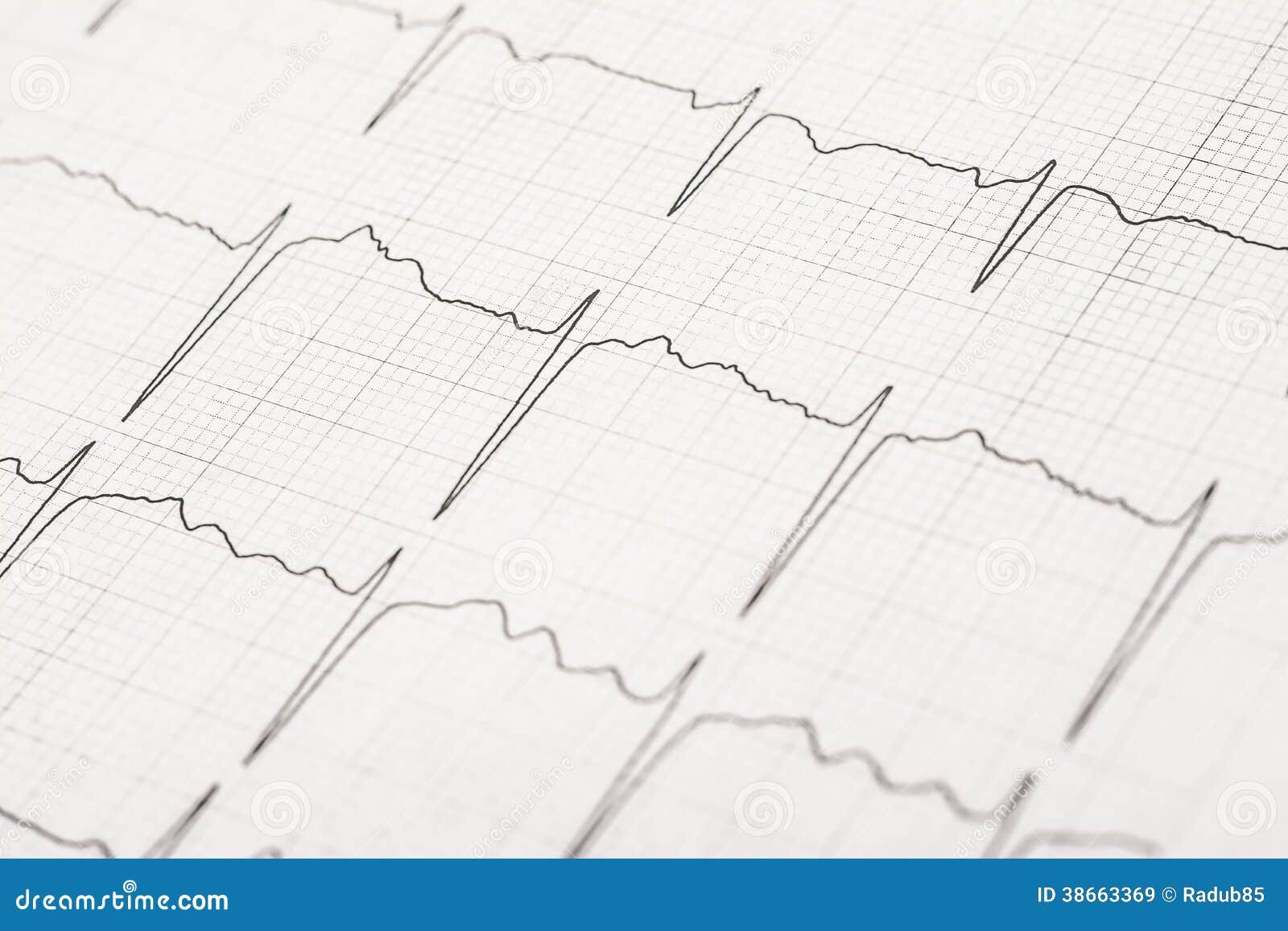 Normal Electrocardiogram Record Waves Stock Image - Image of graphic ...