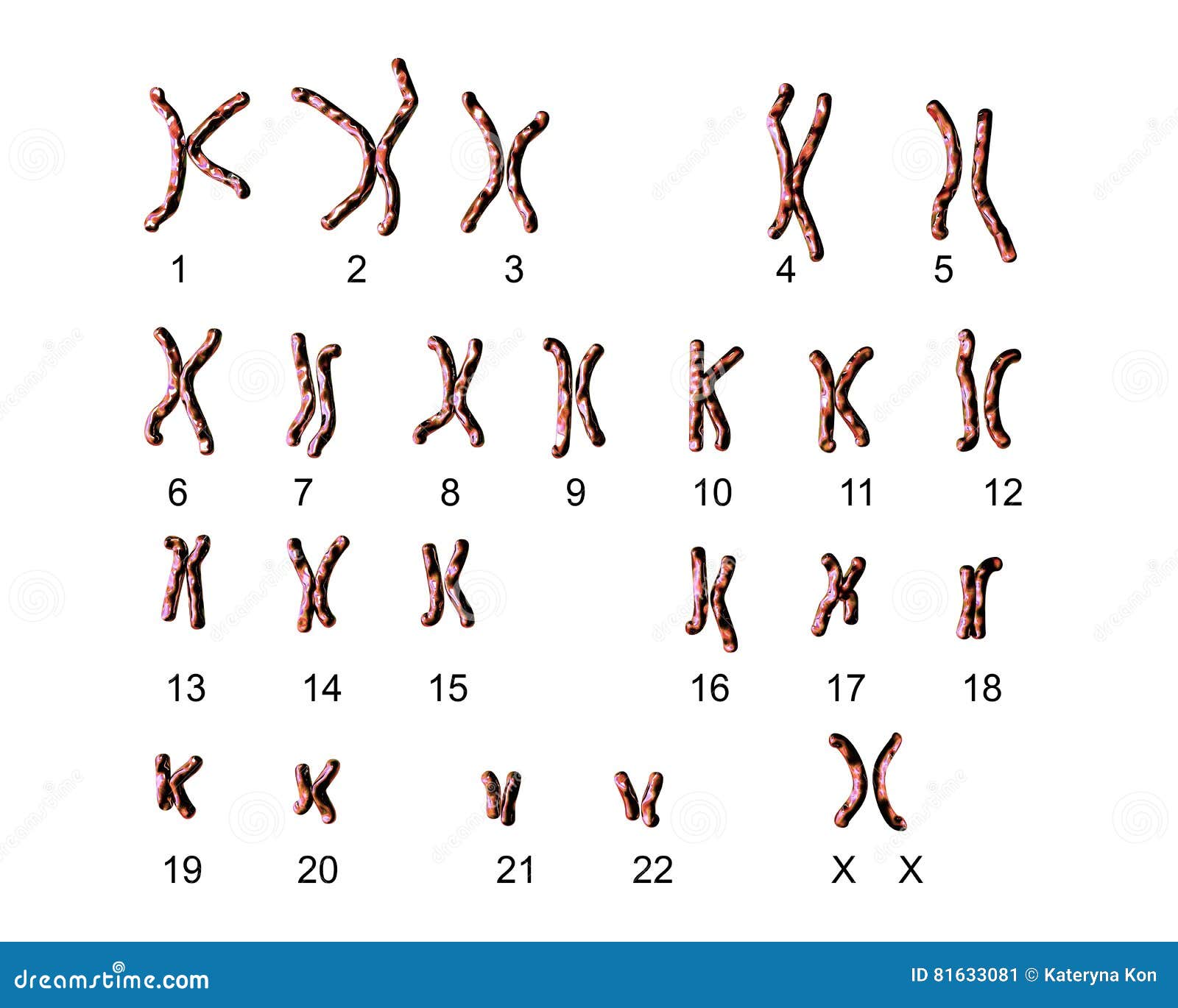 Normal Human Female Karyotype Stock Illustration - Illustration of ...