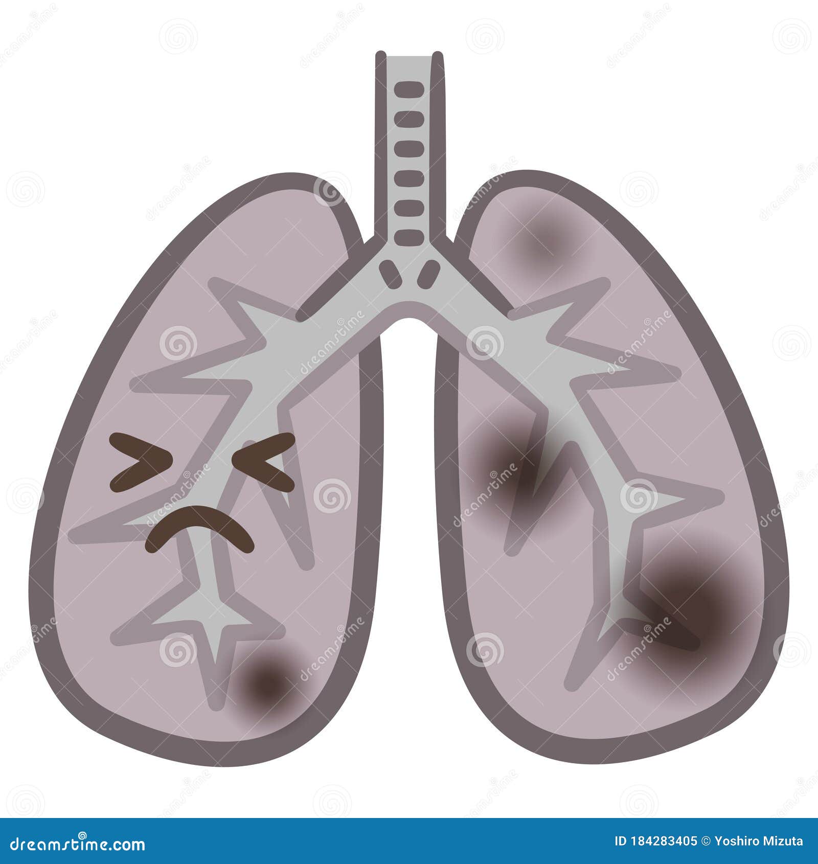 Normal Lung and Lung Cancer Illustration Stock Vector - Illustration of ...