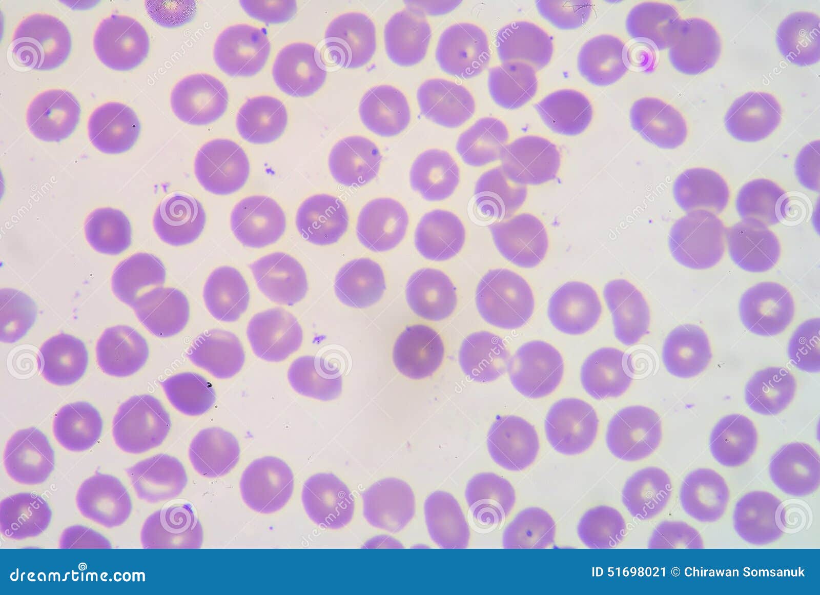 Normal rbc stock image. Image of killer, immune, organism - 51698021