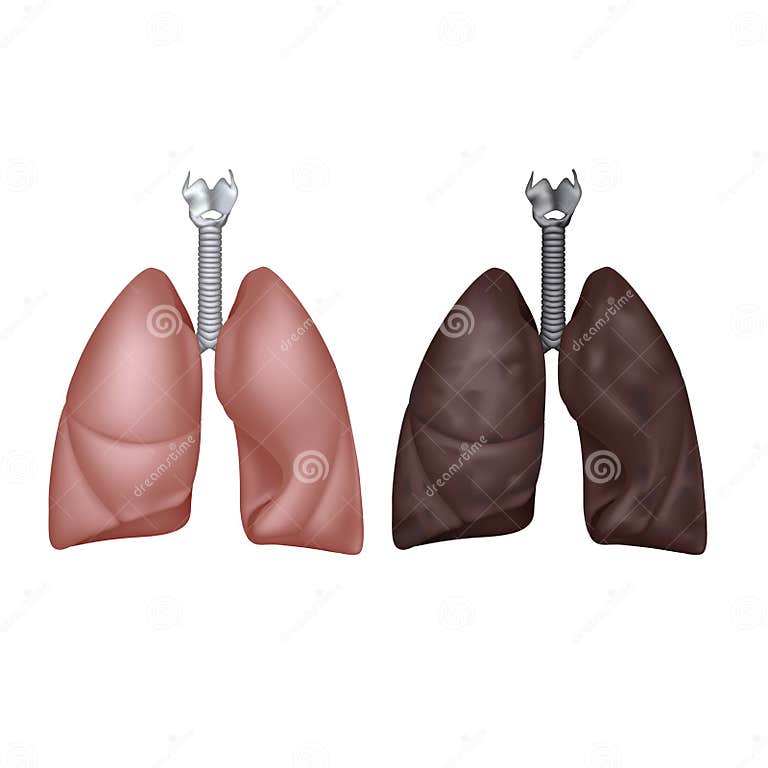Normal and smoker lungs stock vector. Illustration of healthy - 67891288