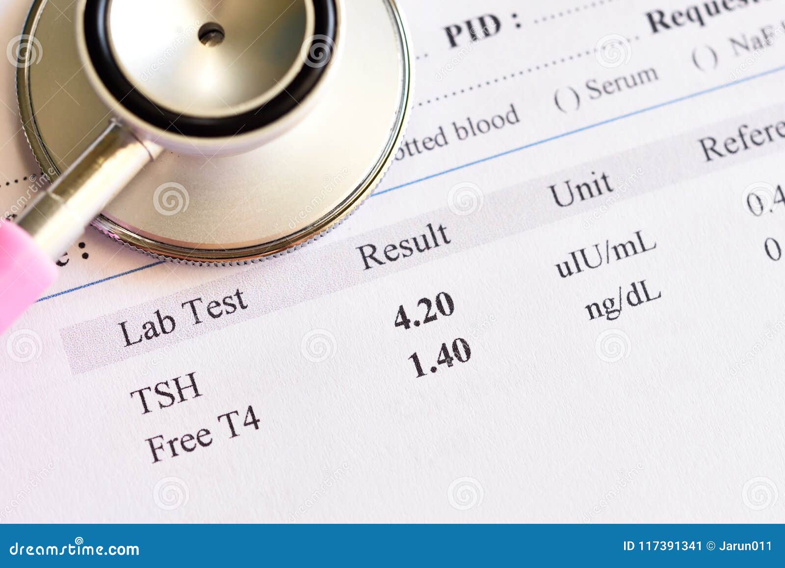 Normal Thyroid Hormone Test Result Stock Image - Image of abnormal ...