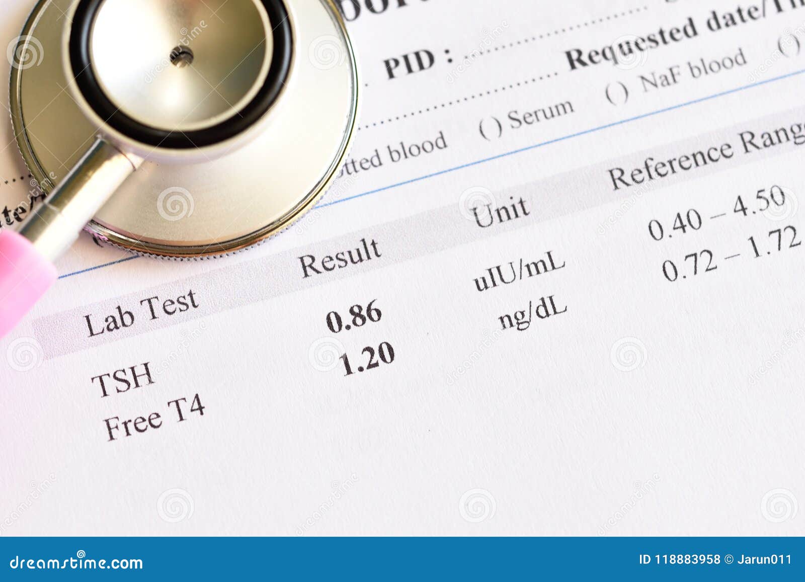Normal Thyroid Hormone Test Result Stock Photo - Image of blood ...
