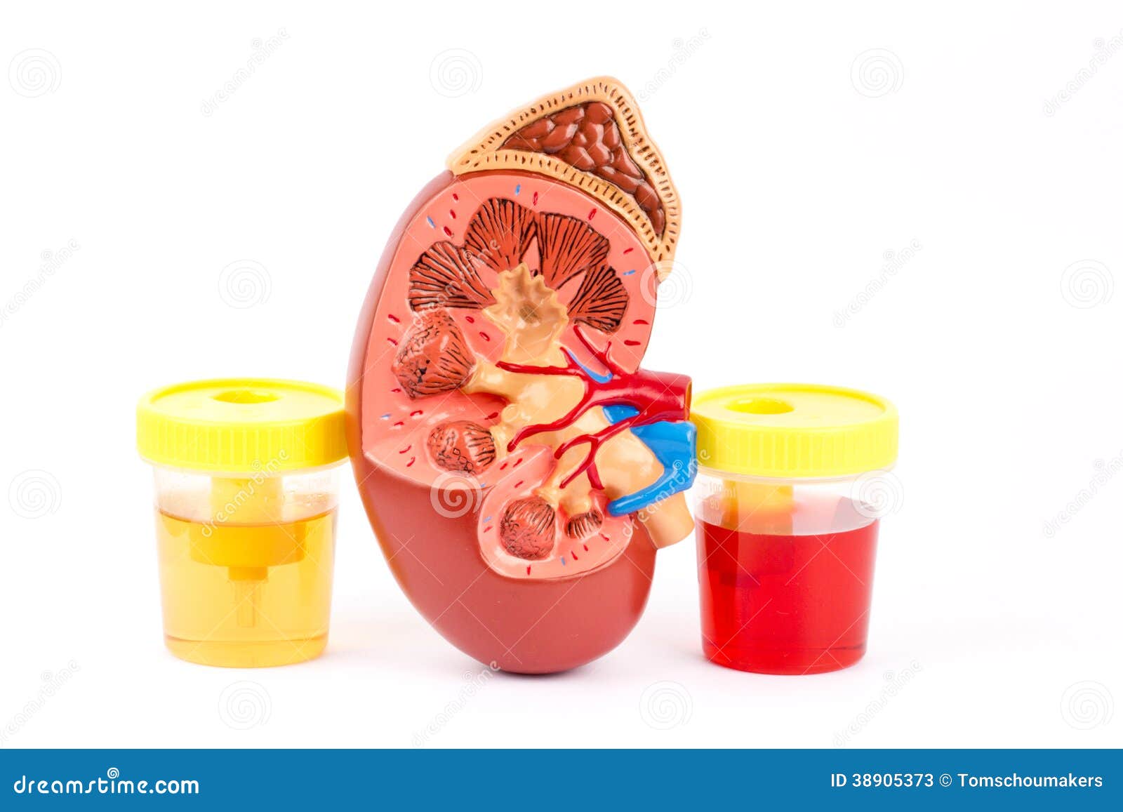 Normal Urin, Njure En Blodig Urin Fotografering för Bildbyråer - Bild ...