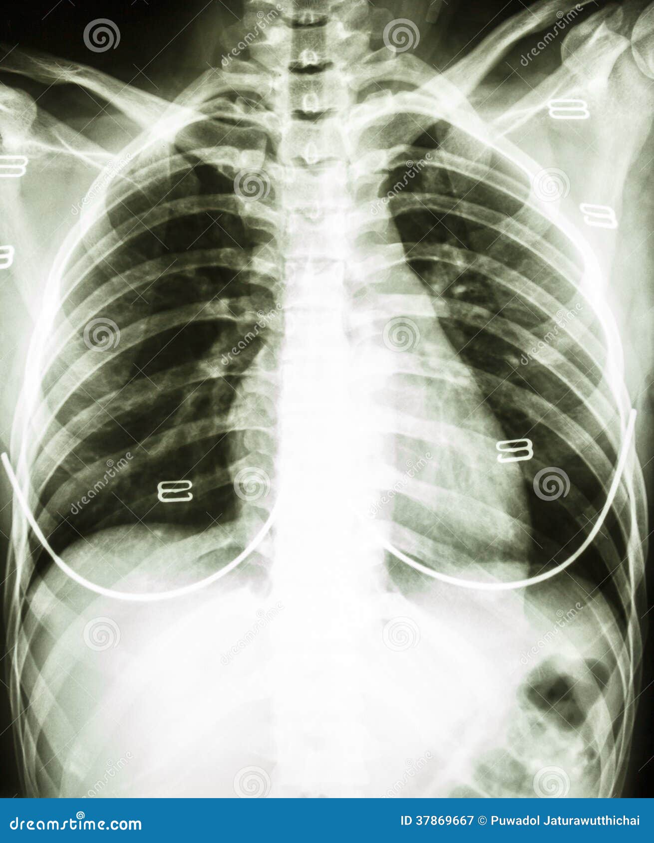 Normal Woman S Chest with Bra Stock Image - Image of bosom, anatomy ...