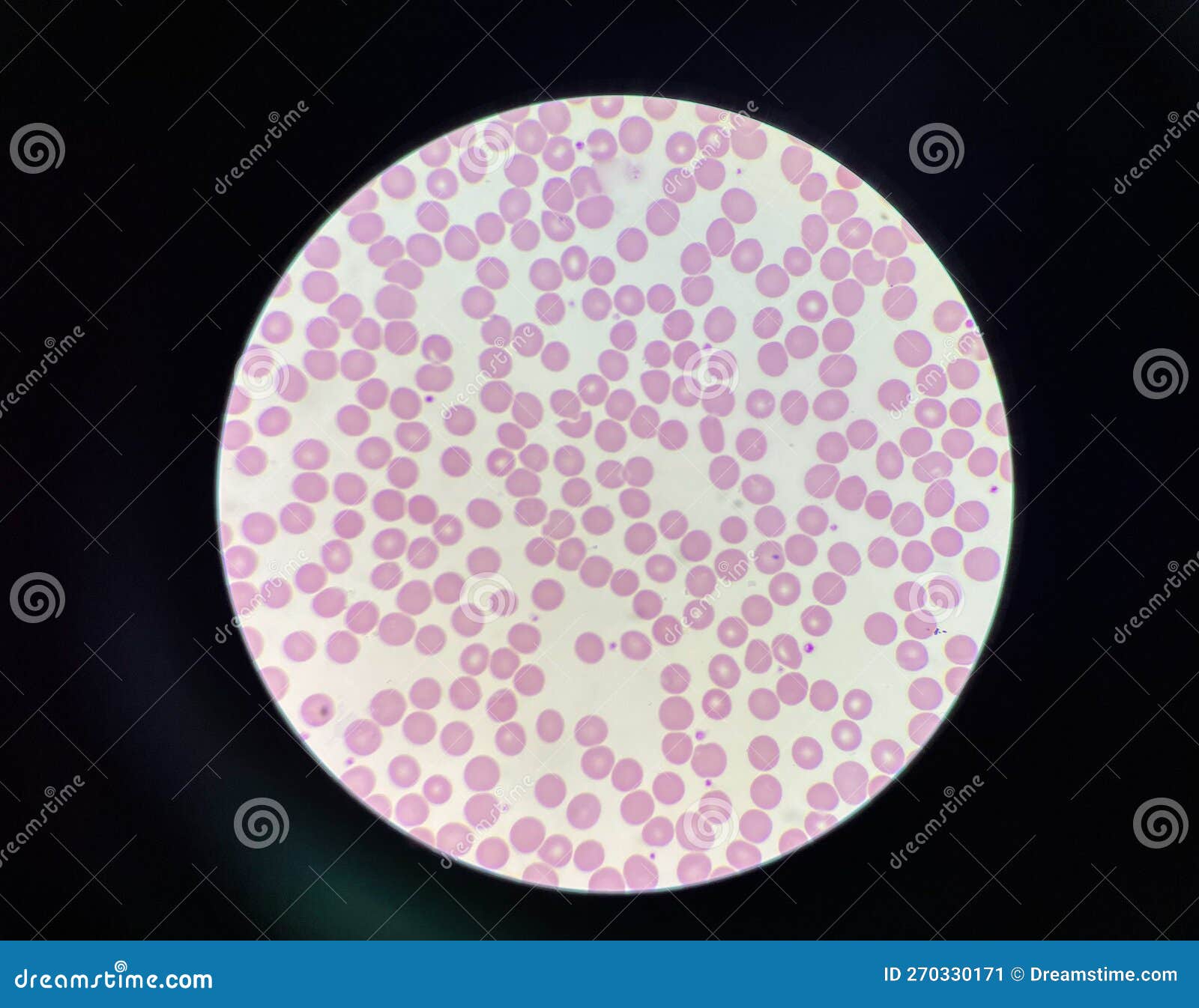 Normalchromic Normocytic Red Blood Cell Stock Image - Image of anatomy ...