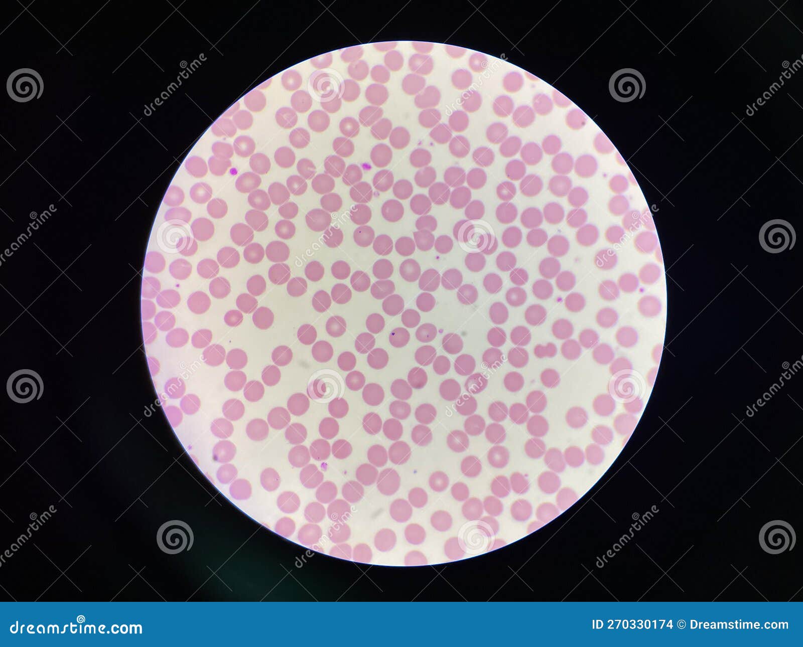 Normalchromic Normocytic Red Blood Cell Stock Photo - Image of ...