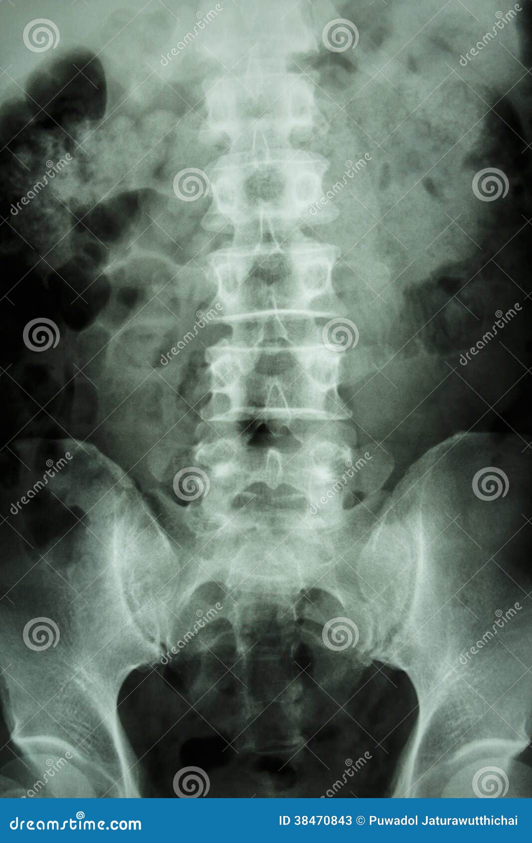 Normale Menselijke Lumbaal-sacrumstekel Stock Afbeelding - Image of ...