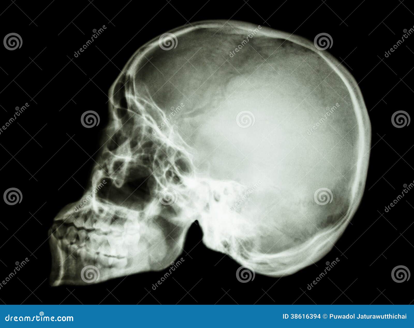 Normale mensenschedel stock foto. Image of schedel, geneeskunde - 38616394